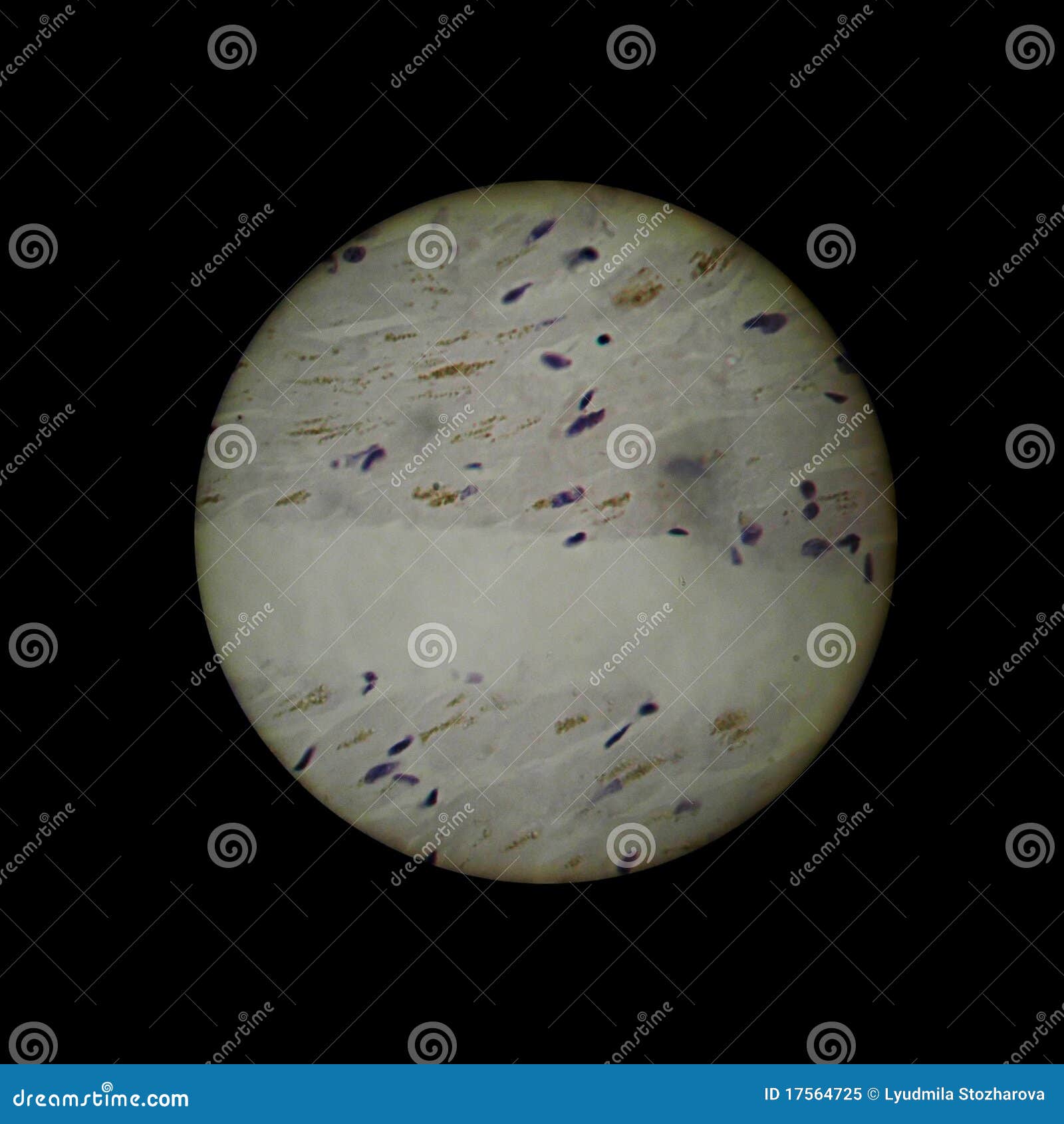 Brown myocardial atrophy stock image. Image of biology - 17564725