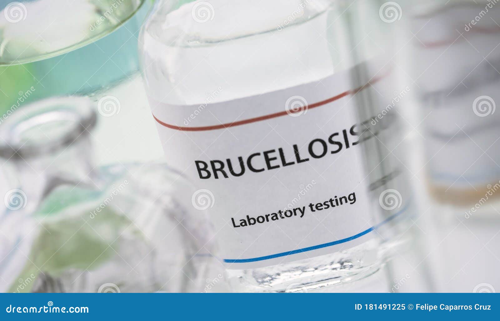 Brucelose De Teste Em Laboratório Imagem de Stock - Imagem de bactérias ...