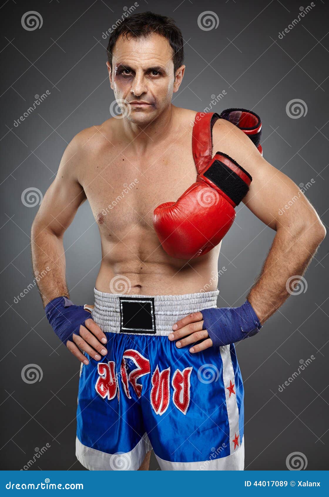 Bruised Fighter after Match Stock Image - Image of hands, caucasian ...