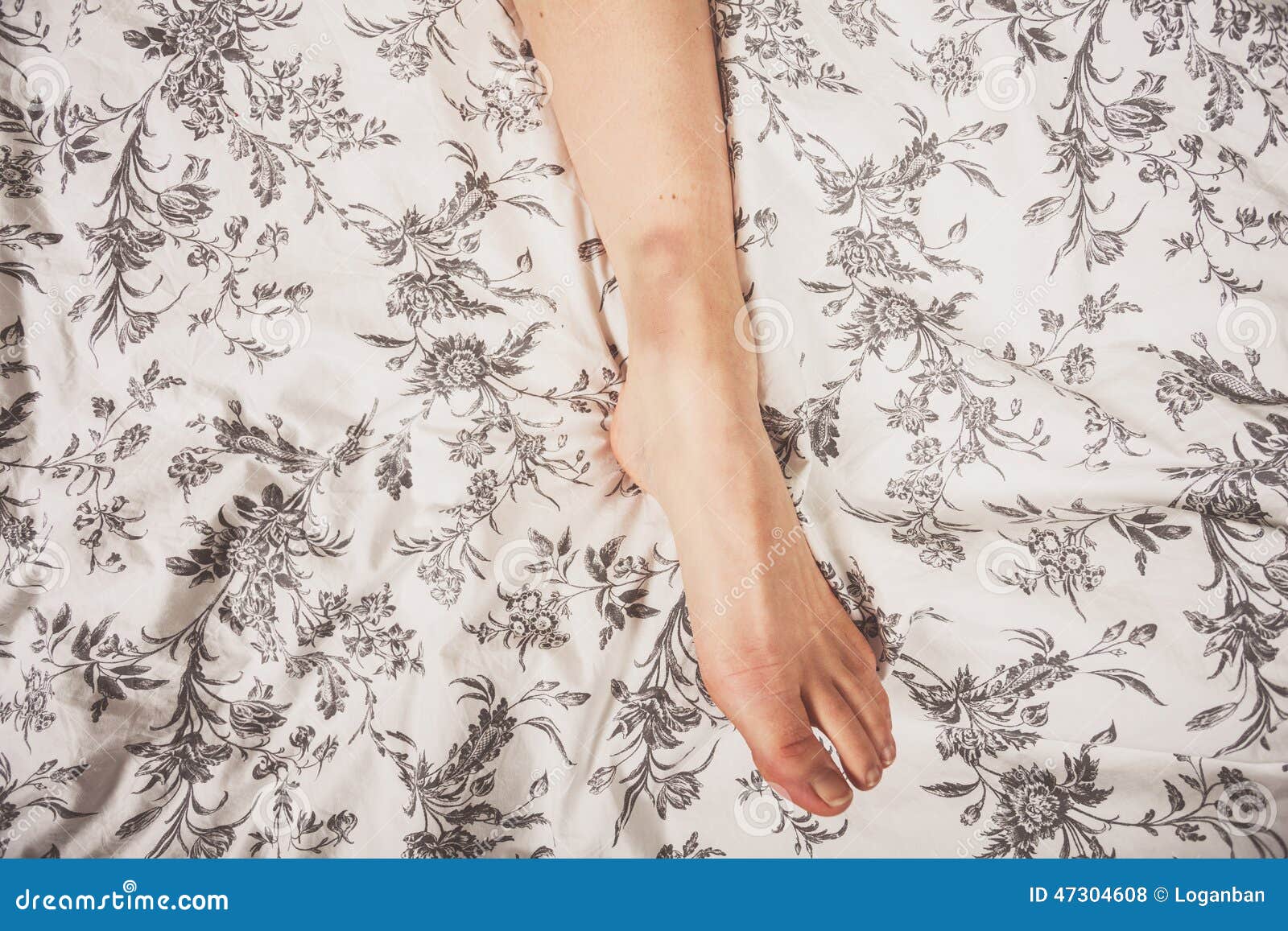 Bruised leg in bed stock photo. Image of abuse, interior - 47304608