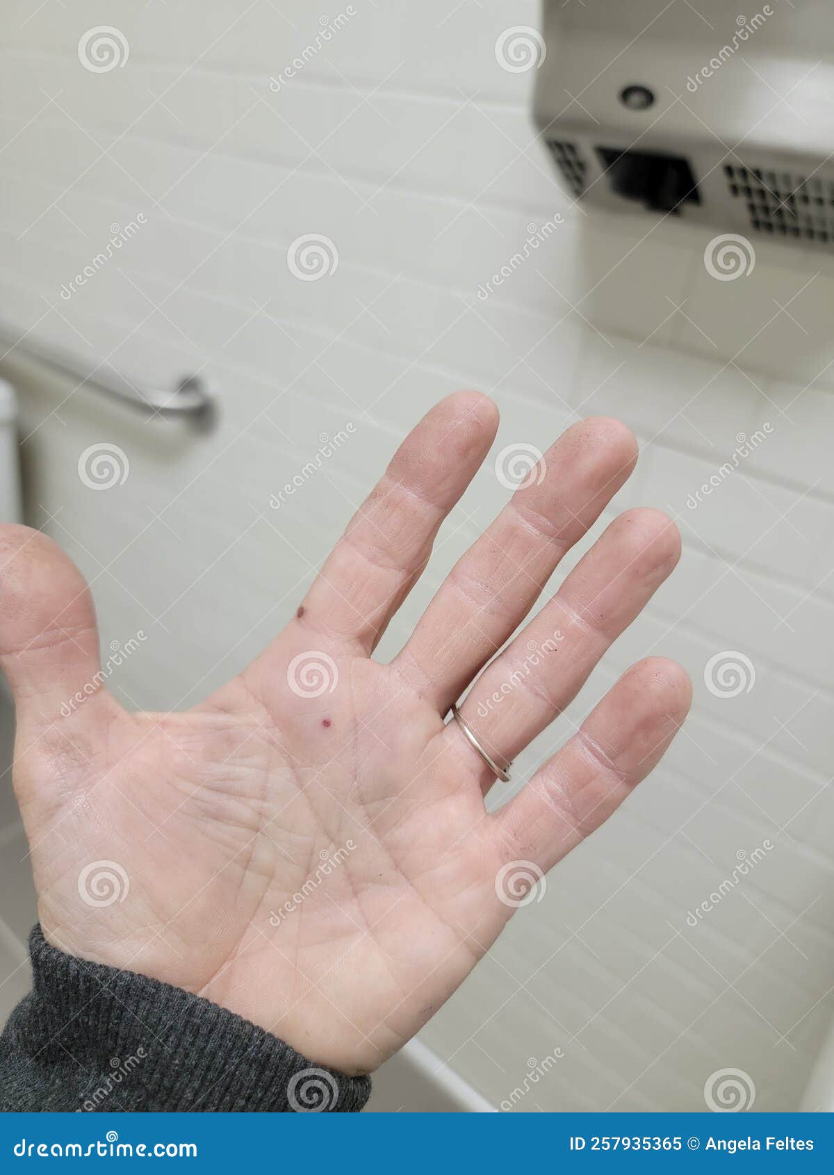 Bruised Palm Hand Under Hand Dryer Stock Image - Image of germs ...