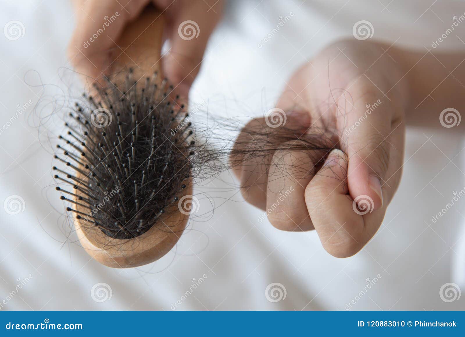 Hair loss problem stock photo. Image of head, beauty - 120883010