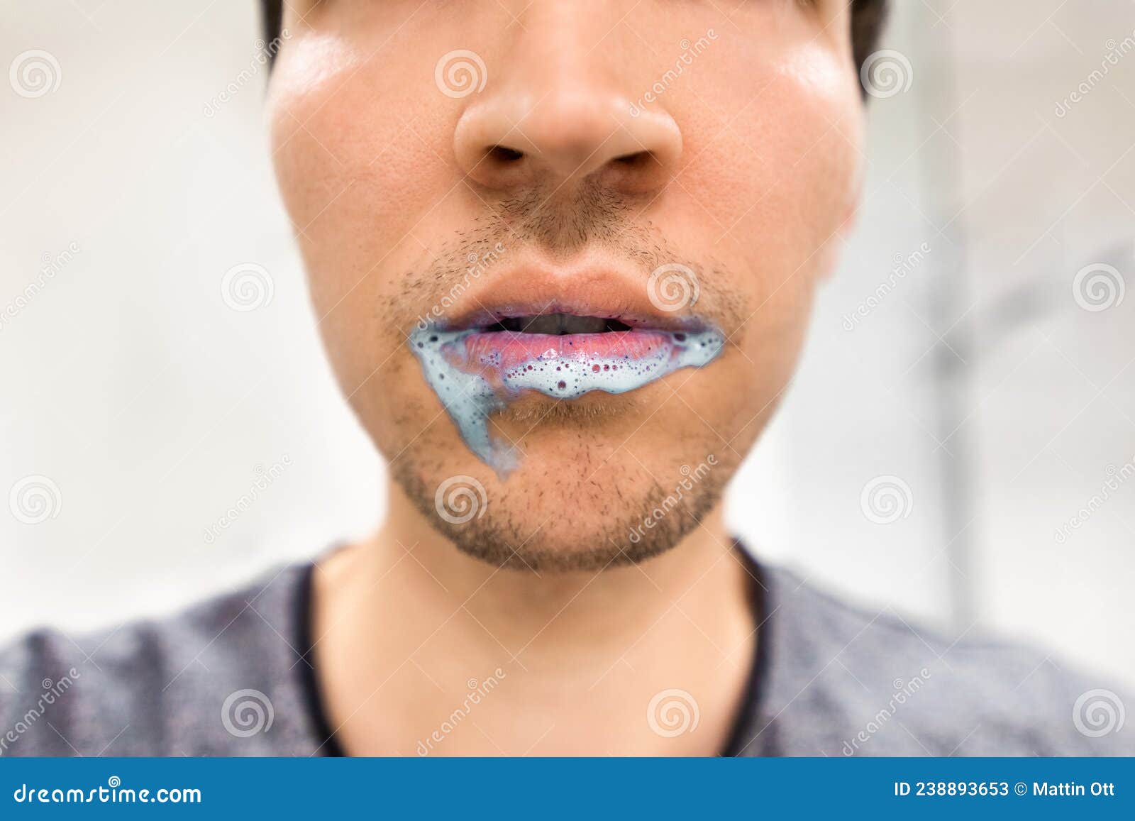 After Brushing His Teeth the Foam of Toothpaste Left on His Mouth Stock ...