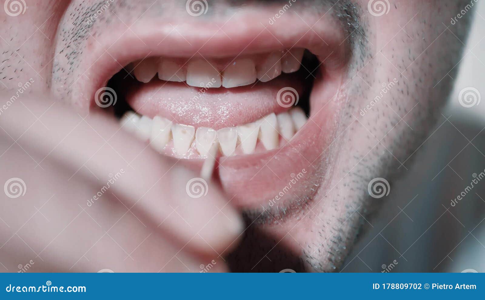 Brushing Teeth with a Toothpick. Cleaning Teeth by Toothpick after ...