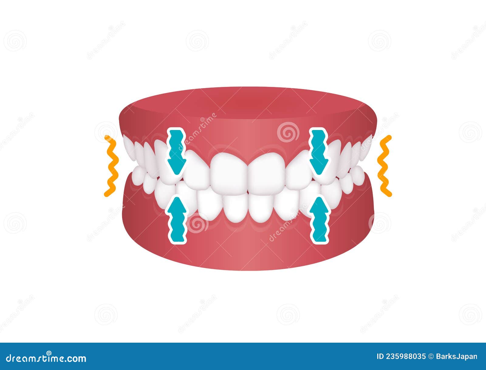 Bruxism Vector Illustration | Grinding Teeth | CartoonDealer.com #235988036