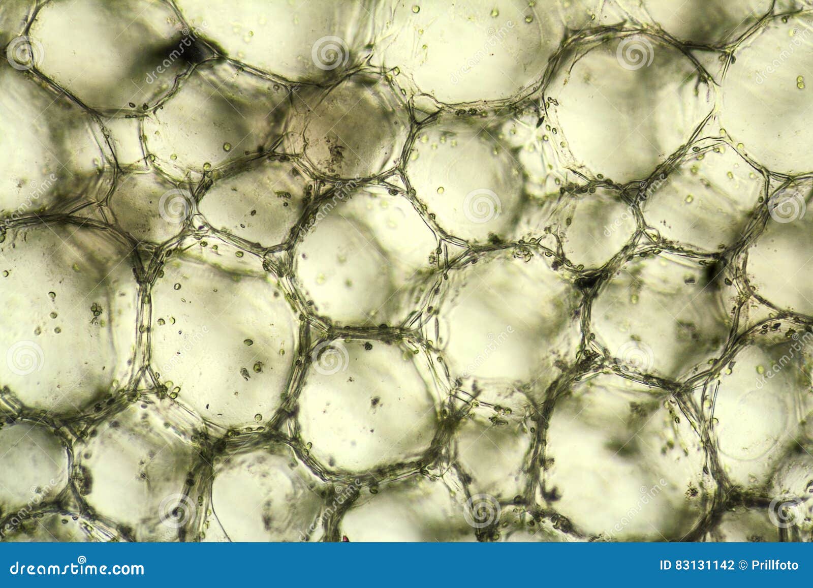 Bryophyllum cell structure stock photo. Image of micrography - 83131142