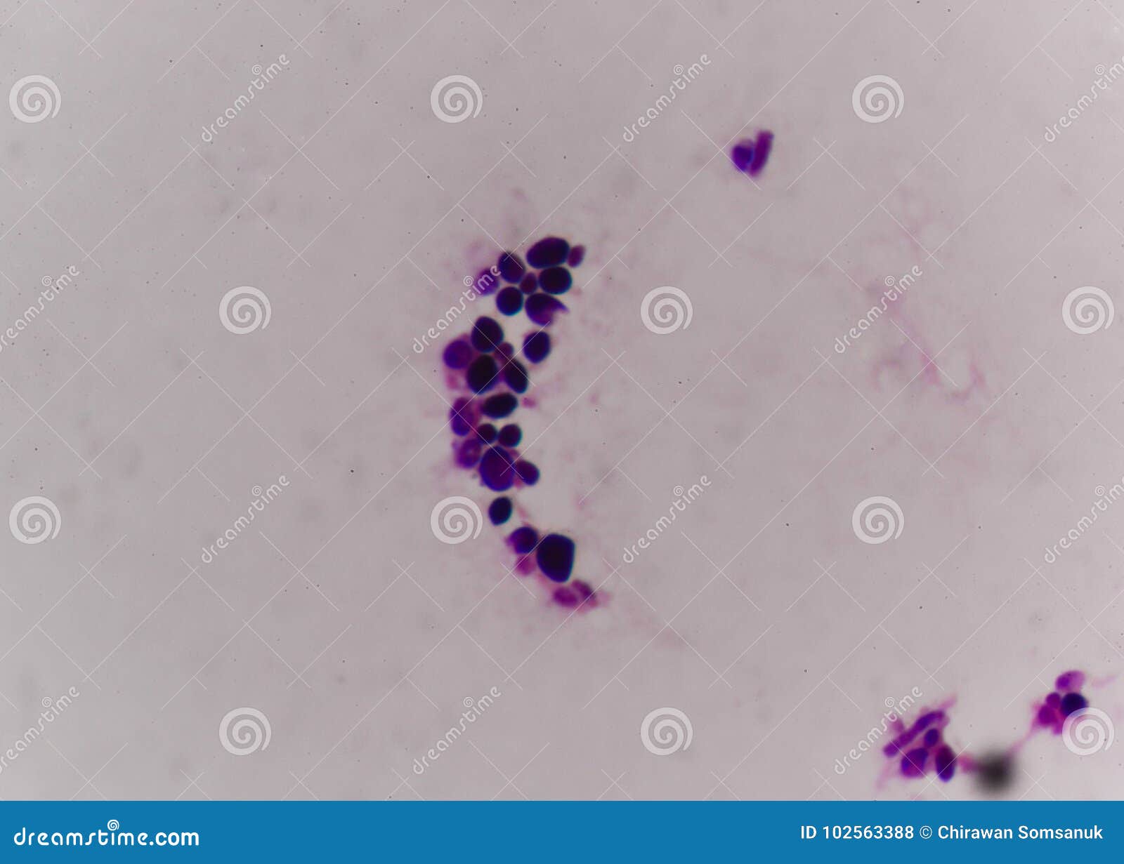 Yeast Cell Gram Stain Yeast Cell Gram Stain