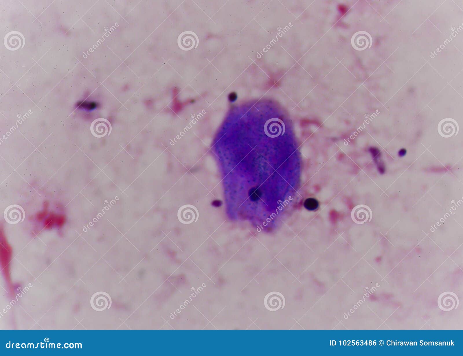Budding Yeast Cell in Gram Stain Method. Stock Photo - Image of ...