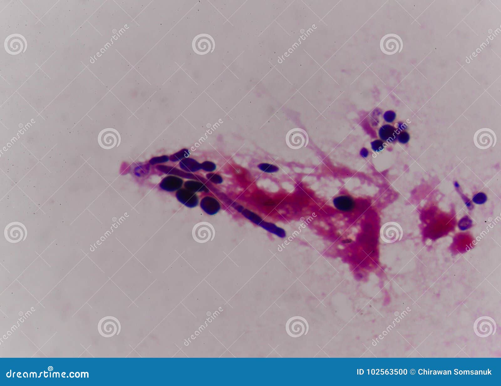 Budding Yeast Cell in Gram Stain Method. Stock Photo - Image of ...
