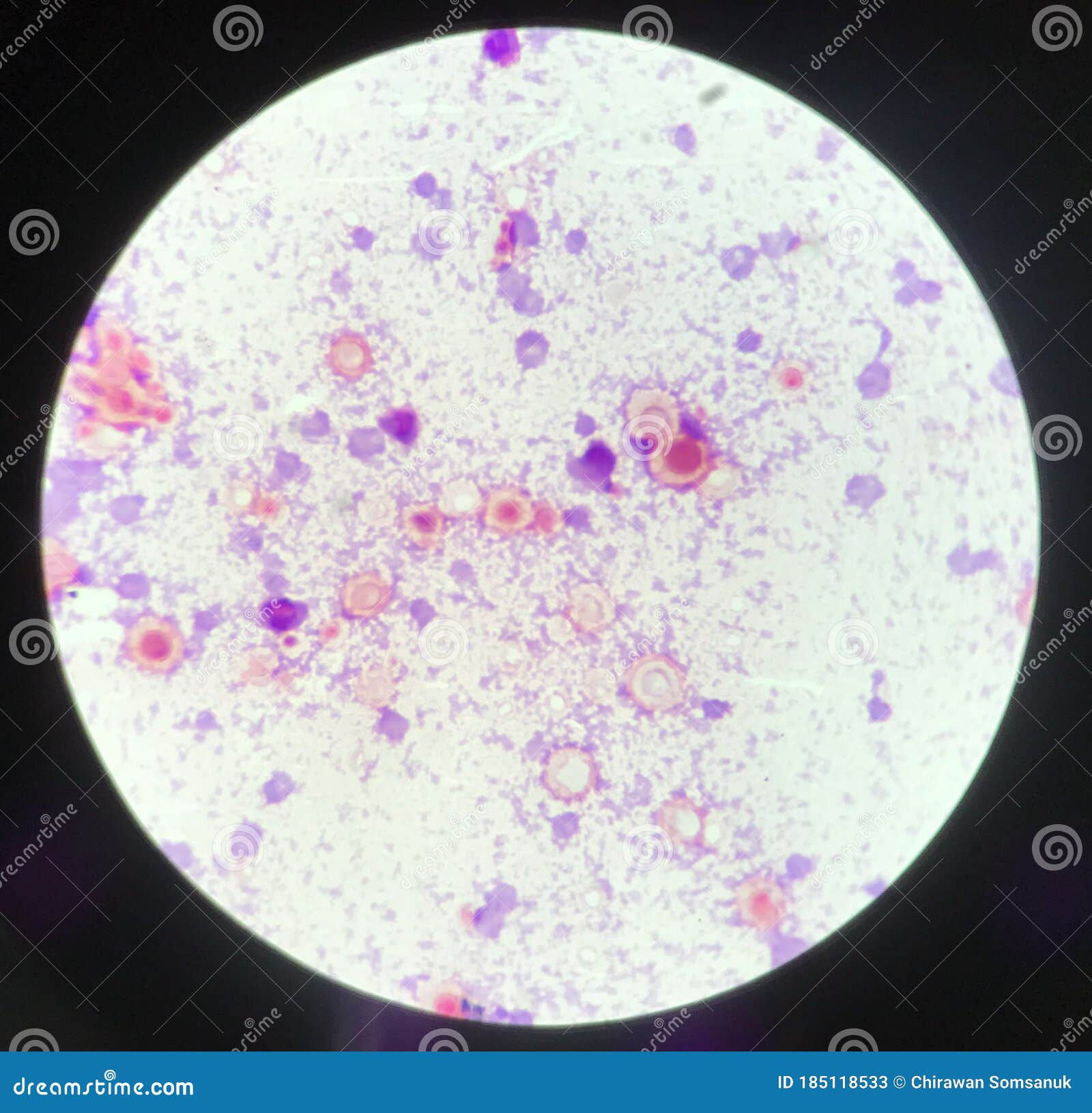 Budding Yeast Cell Structure Find With Microscope In Laboratory Stock Image Image Of Ferment