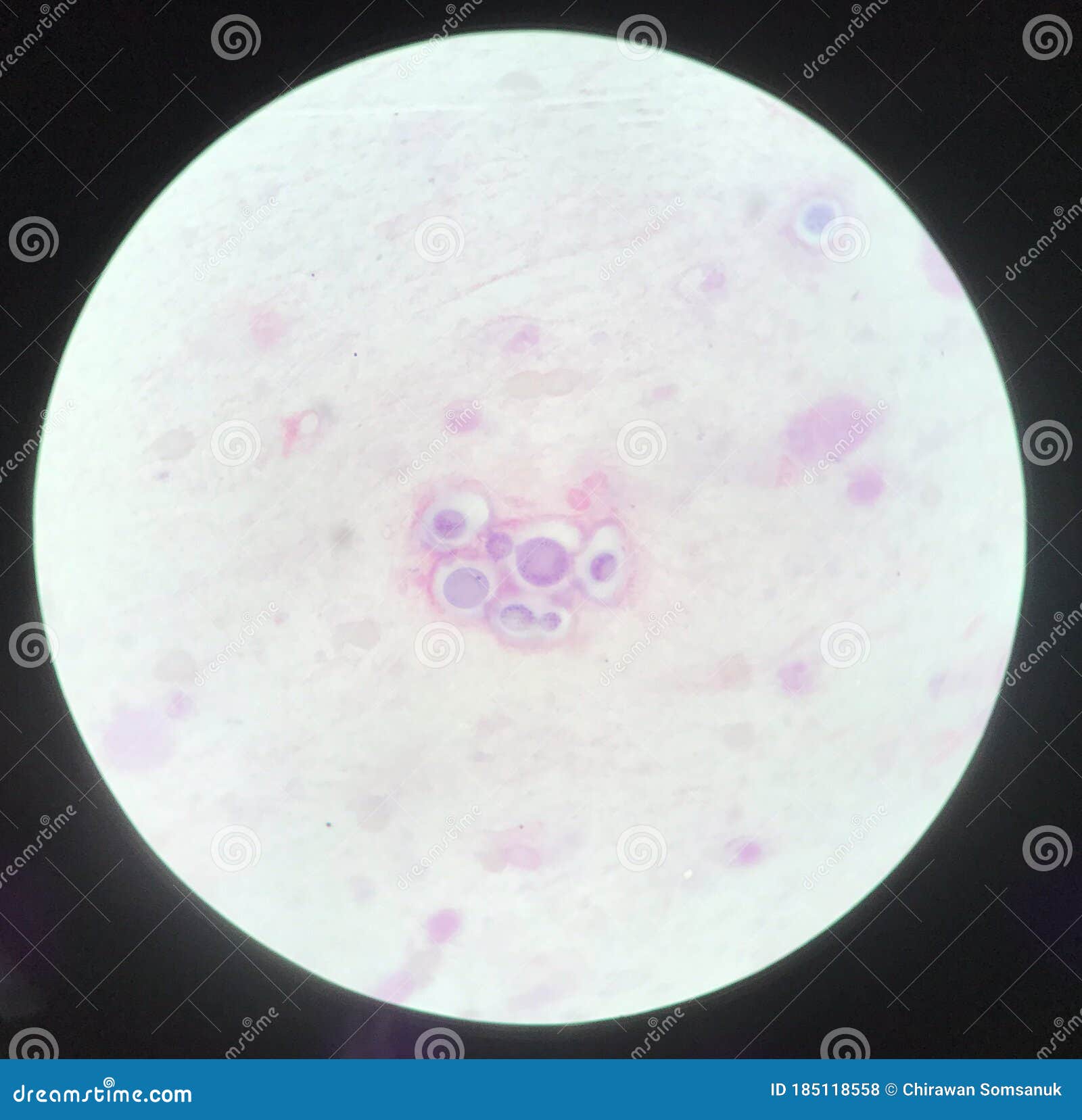 Budding Yeast Cell Structure Find with Microscope in Laboratory Stock ...