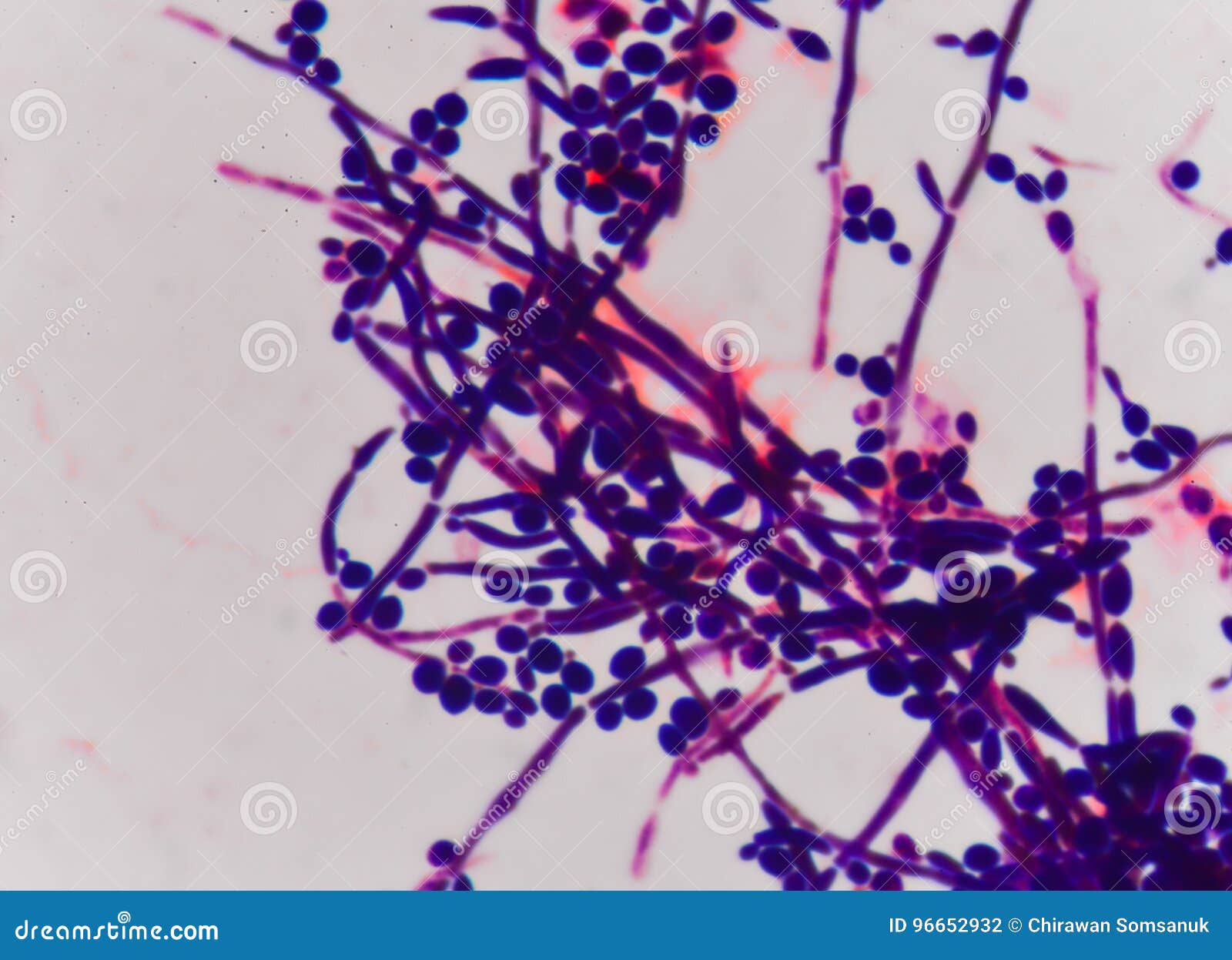 Budding Yeast Cell Structure Stock Photo - Image of organism, human ...