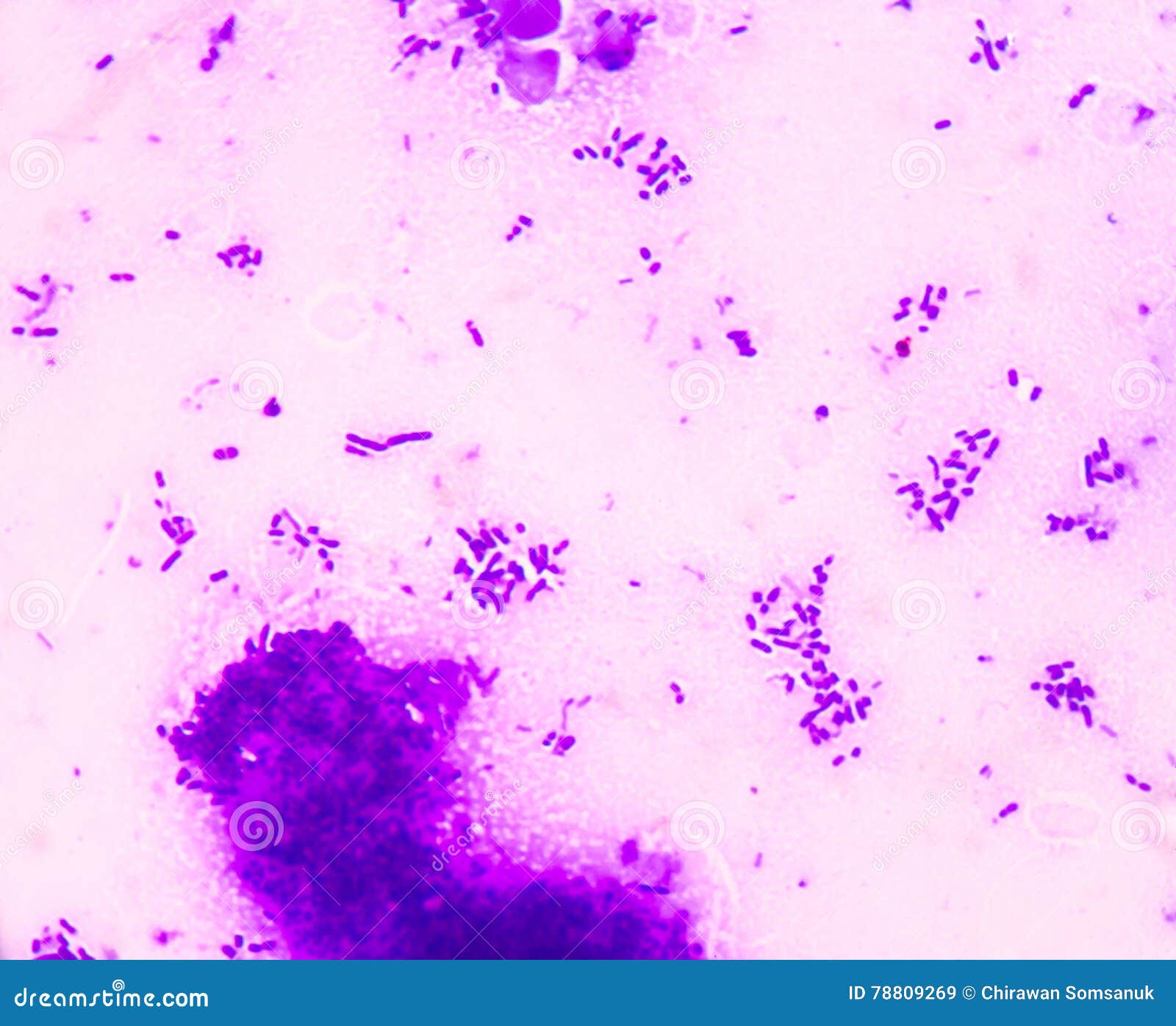 Budding Yeast Cells With Pseudohyphae From Sputum Gram Stain Tes Stock Image