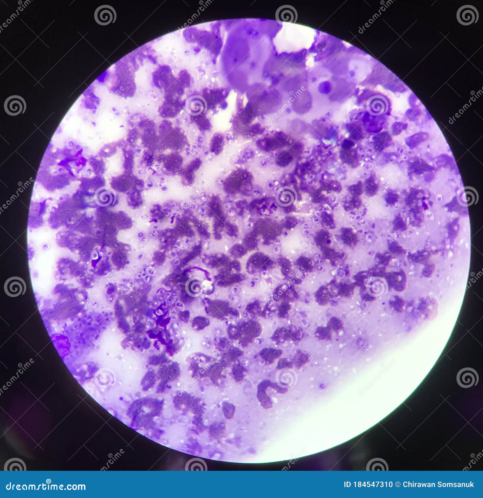 Budding Yeast Cells Binary Fission Cells in Smear Stock Photo - Image ...