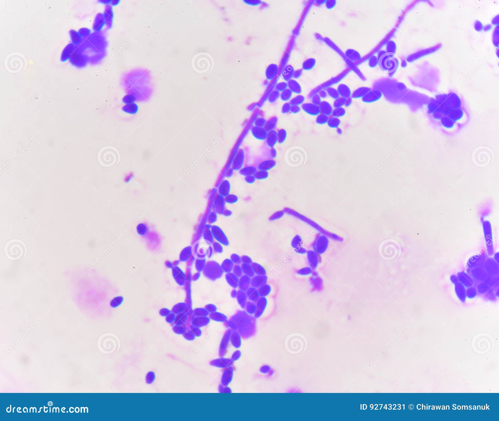 Budding Yeast Cells with Pseudohyphae Stock Image - Image of infection ...