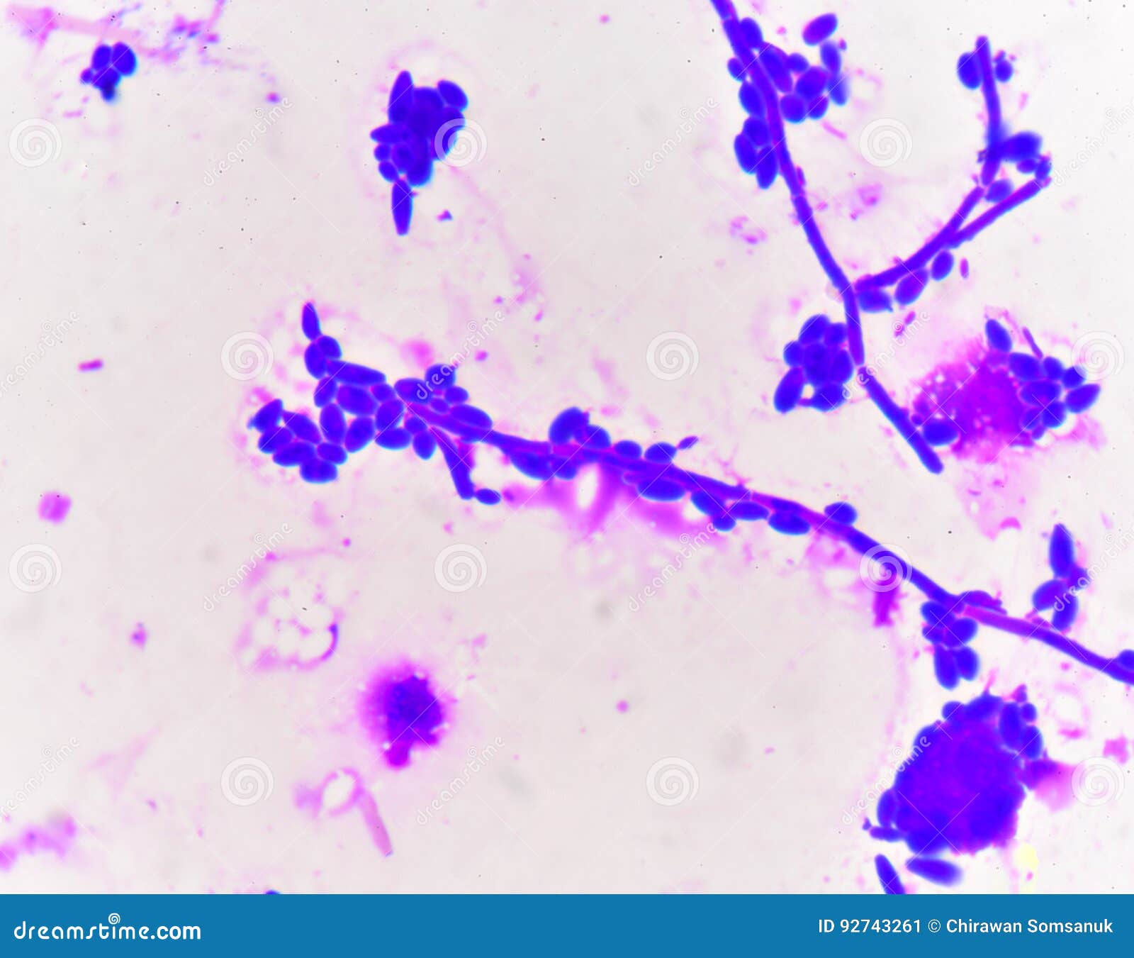 Budding Yeast Cells with Pseudohyphae Stock Image - Image of small ...