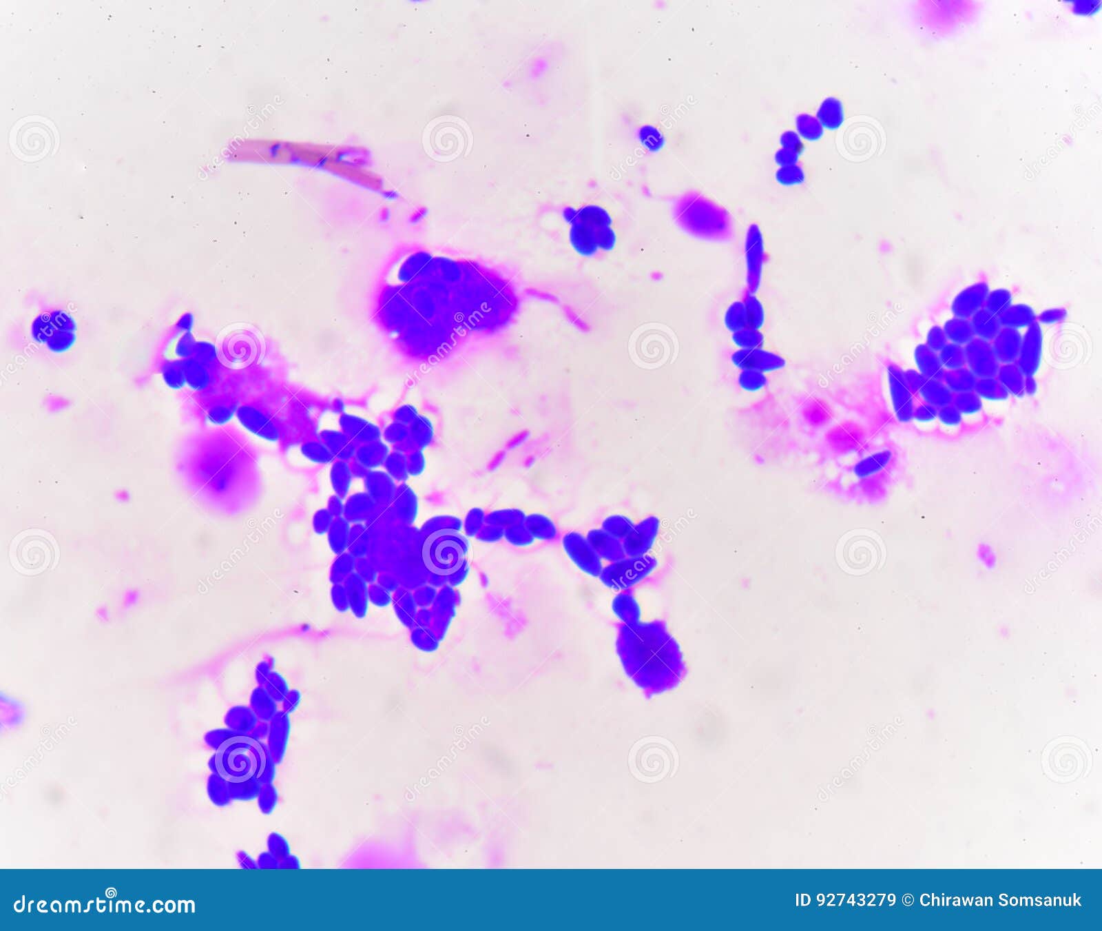 Budding Yeast Cells with Pseudohyphae Stock Image - Image of ...