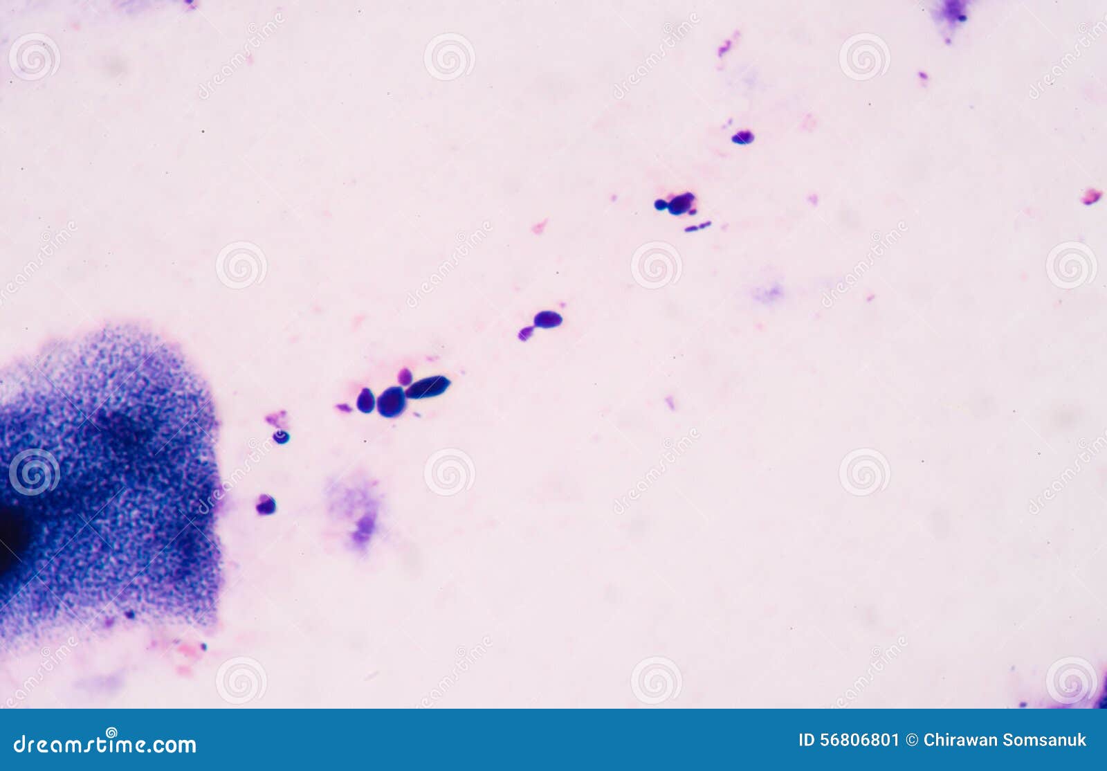 Budding Yeast Gram Stain