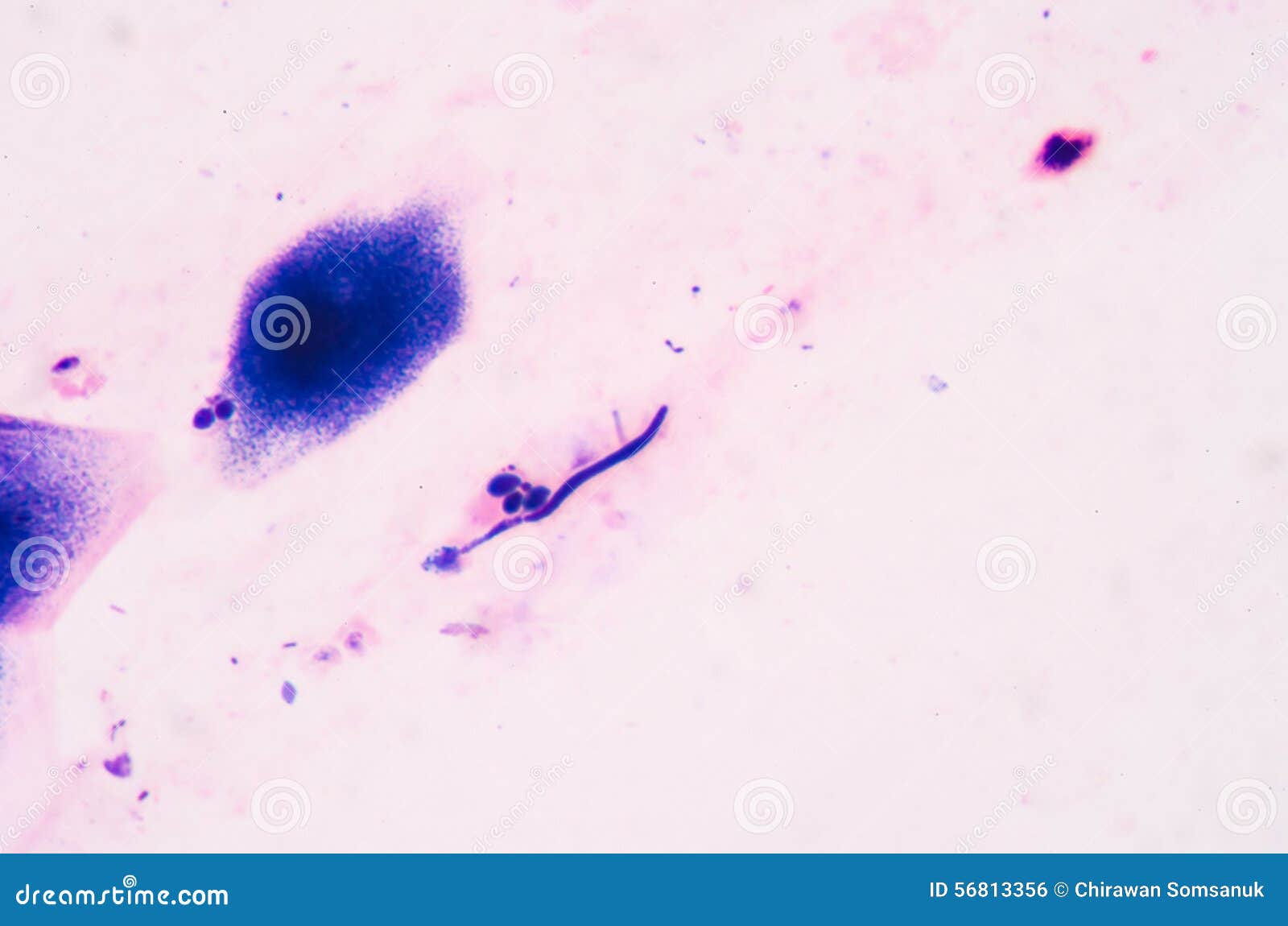 Budding Yeast Cells With Pseudohyphae From Sputum Gram Stain Tes Royalty Free Stock Image
