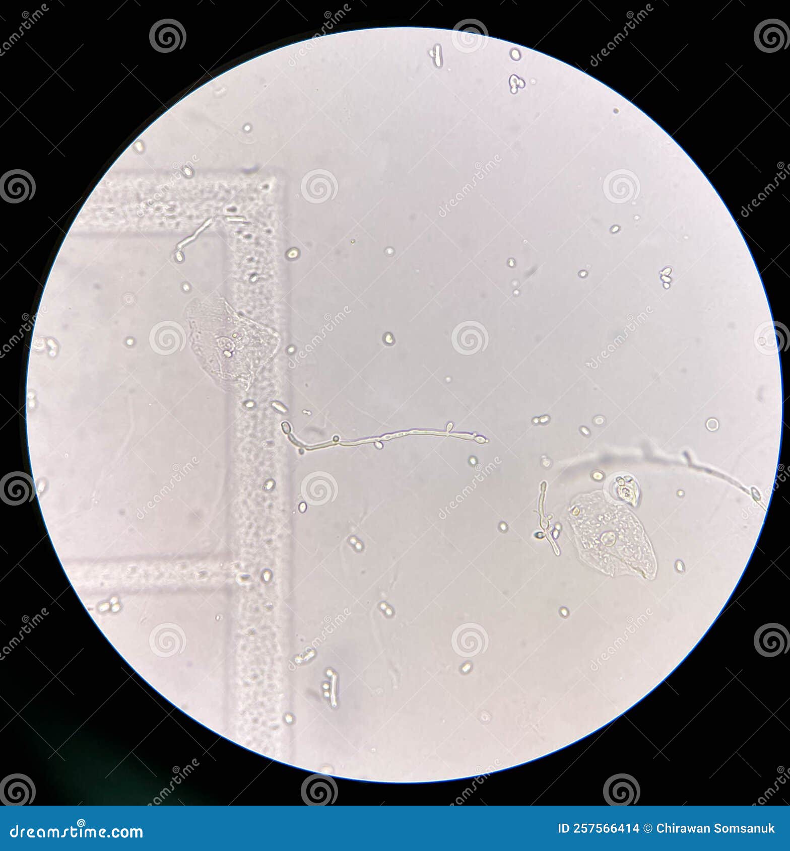 Yeast Cells Under Microscope 40x