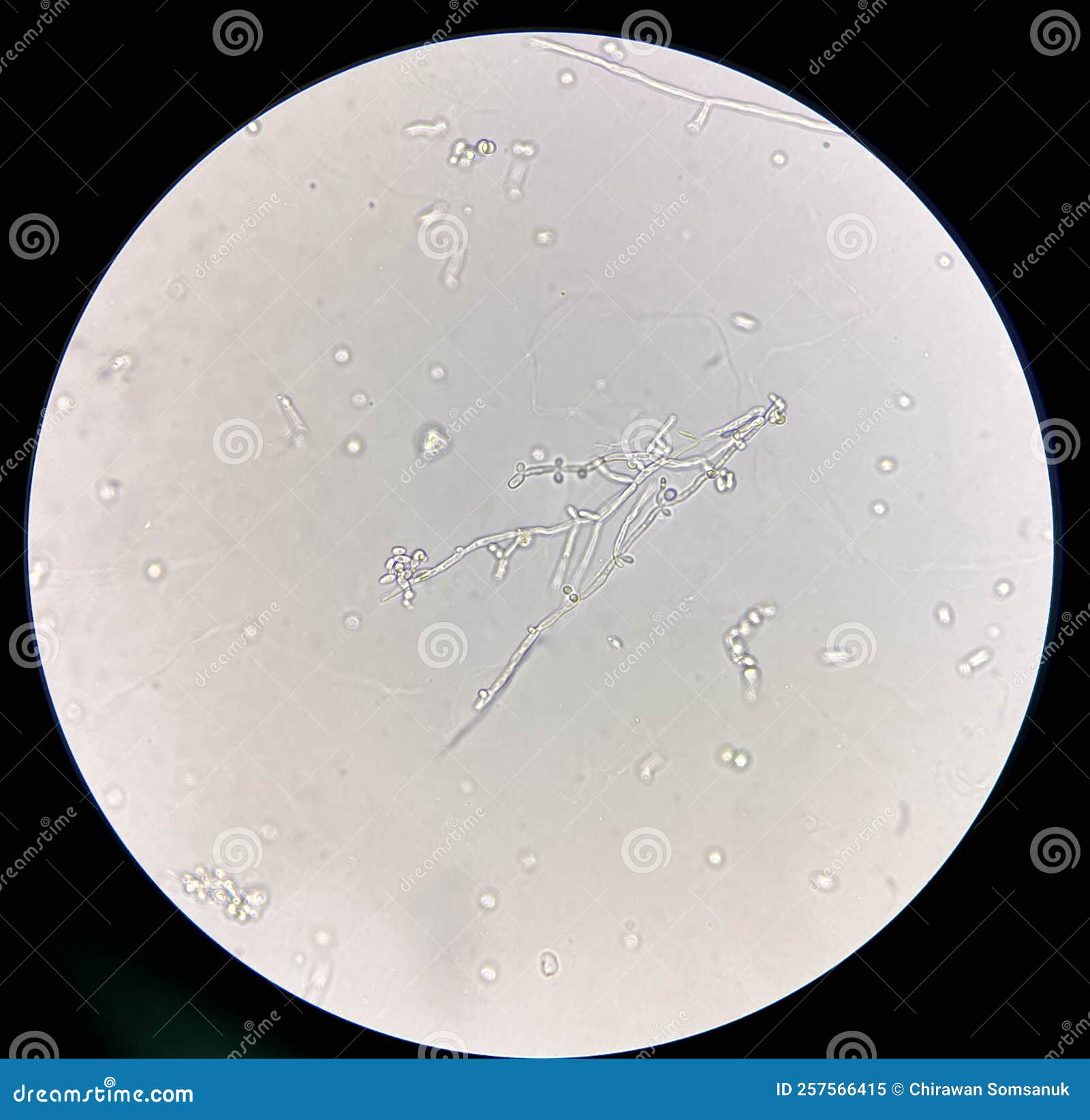Budding Yeast Cells with Pseudohyphae in Urine Sample Stock Image ...