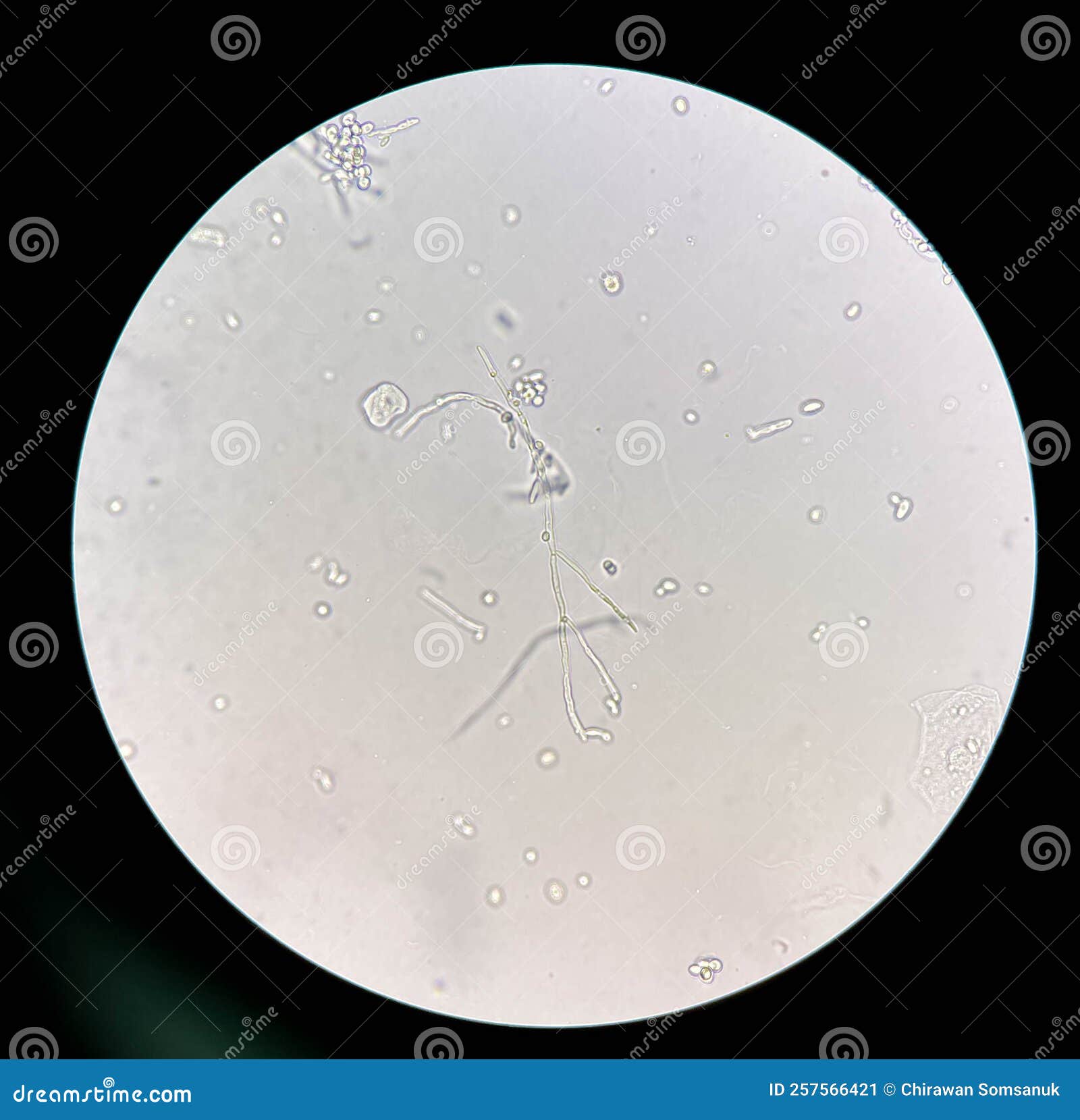 Budding Yeast Cells with Pseudohyphae in Urine Sample Stock Image ...