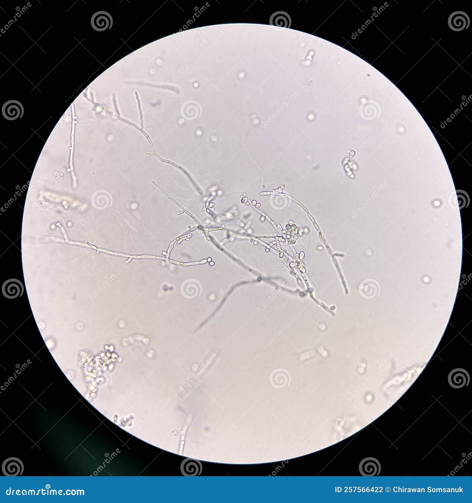Candida In Urine