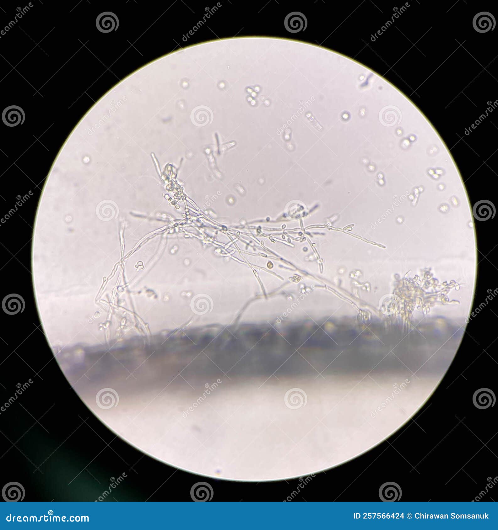 Budding Yeast Cells with Pseudohyphae in Urine Sample Stock Photo ...