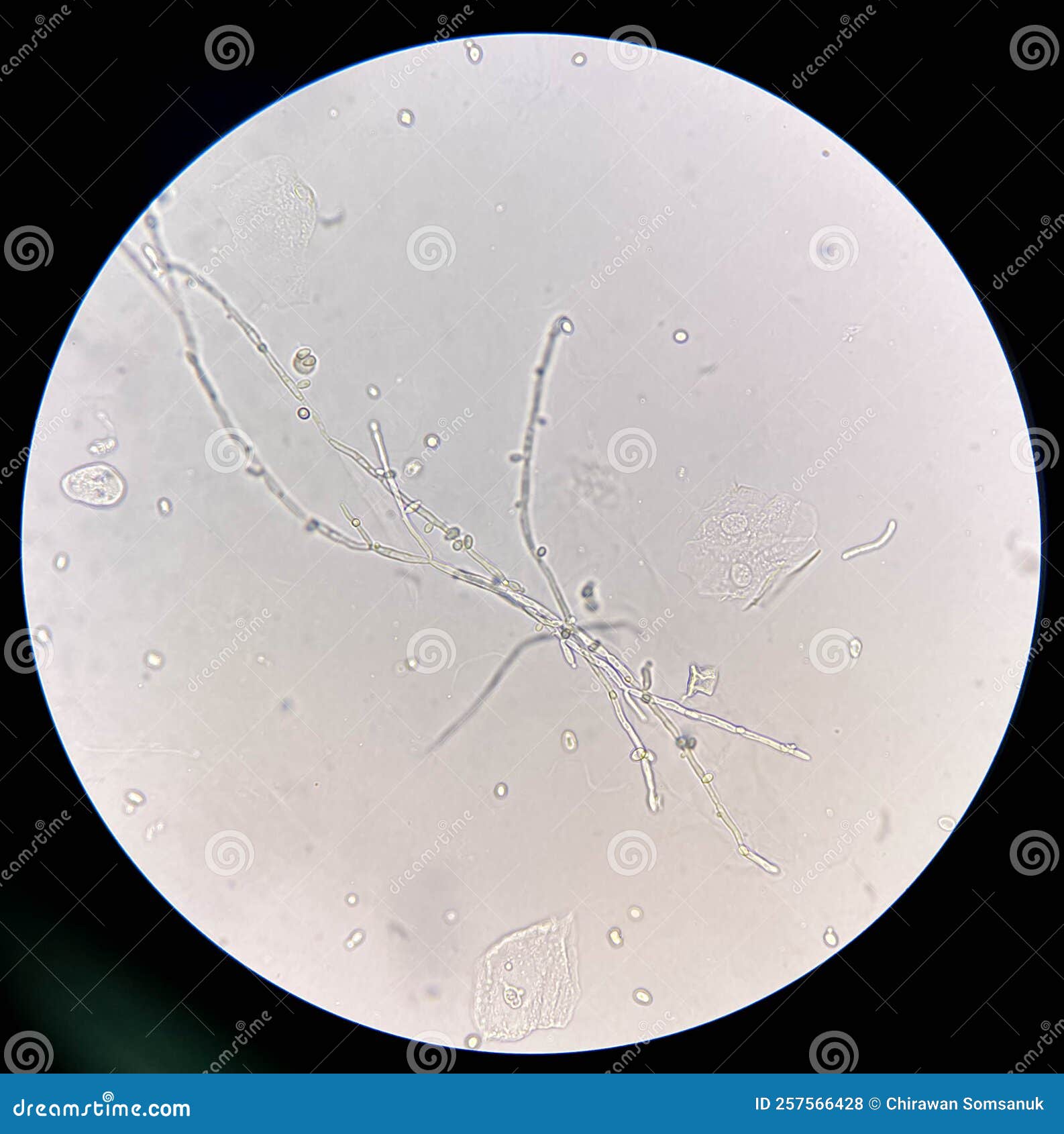 Yeast Cells Under Microscope 40x