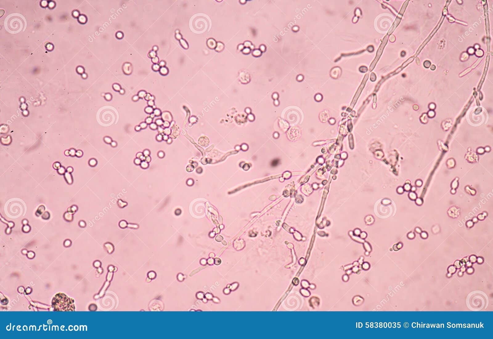 Yeast Cells With Epithelial Tissue Stock Image 91865749