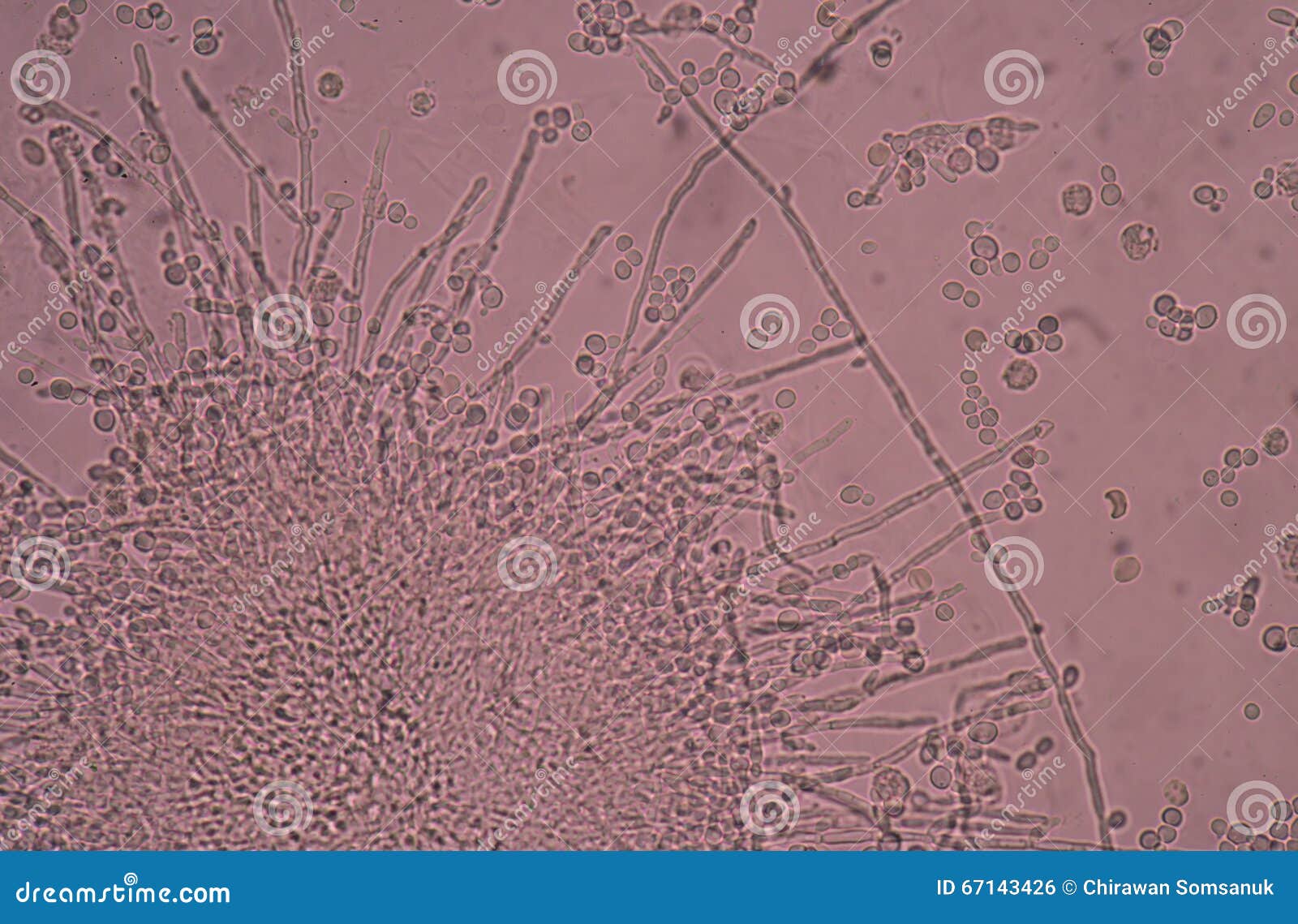 Budding Yeast Cells with Pseudohyphae in Urine Sample. Stock Photo ...