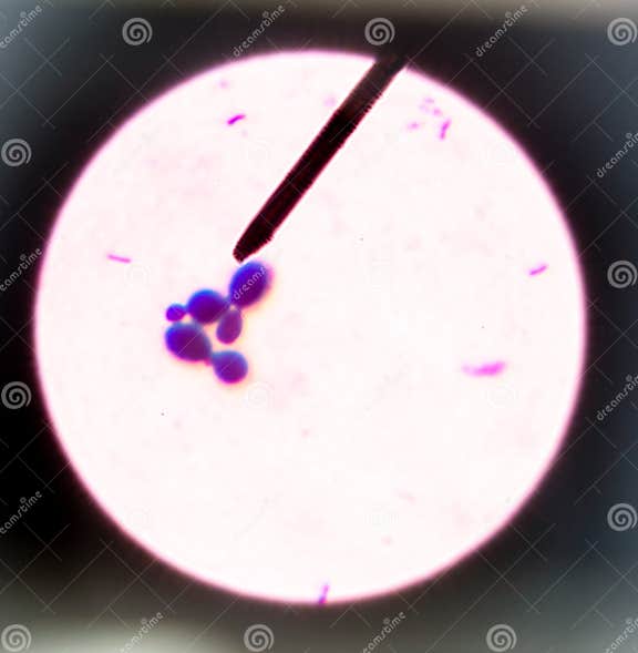 Budding yeast cells. stock photo. Image of candida, infectious - 56807124