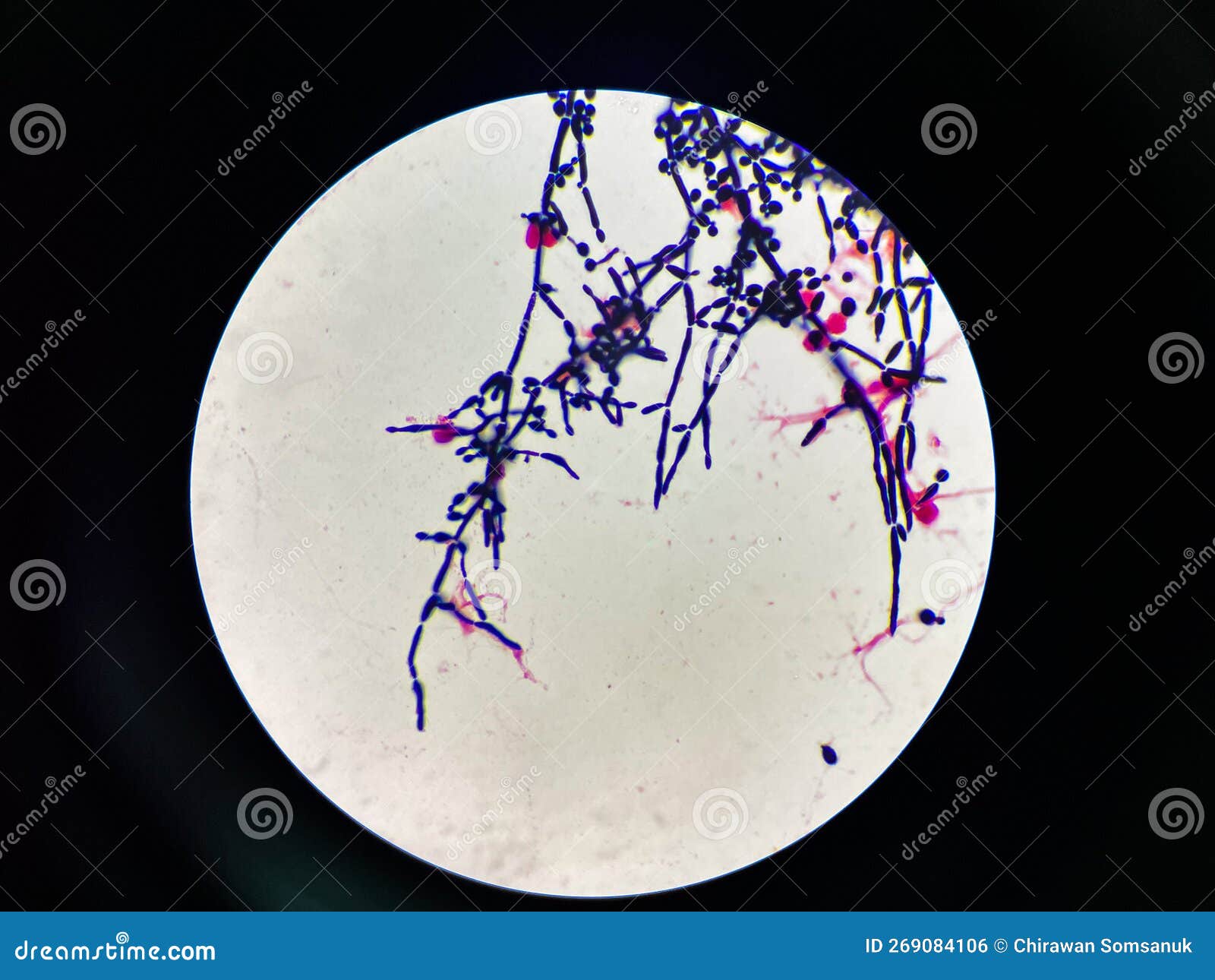 Budding Yeast with Pseudo Hephae in Urine Stock Photo - Image of cells ...