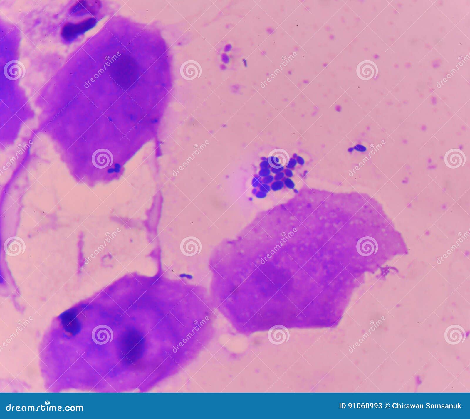 Budding Yeast with Pseudohyphae Stock Image - Image of microscopic ...