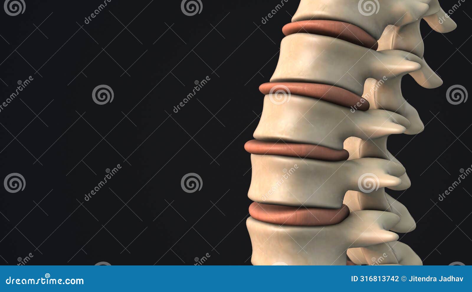 Bulging Disc In The Human Spine Stock Photography | CartoonDealer.com ...