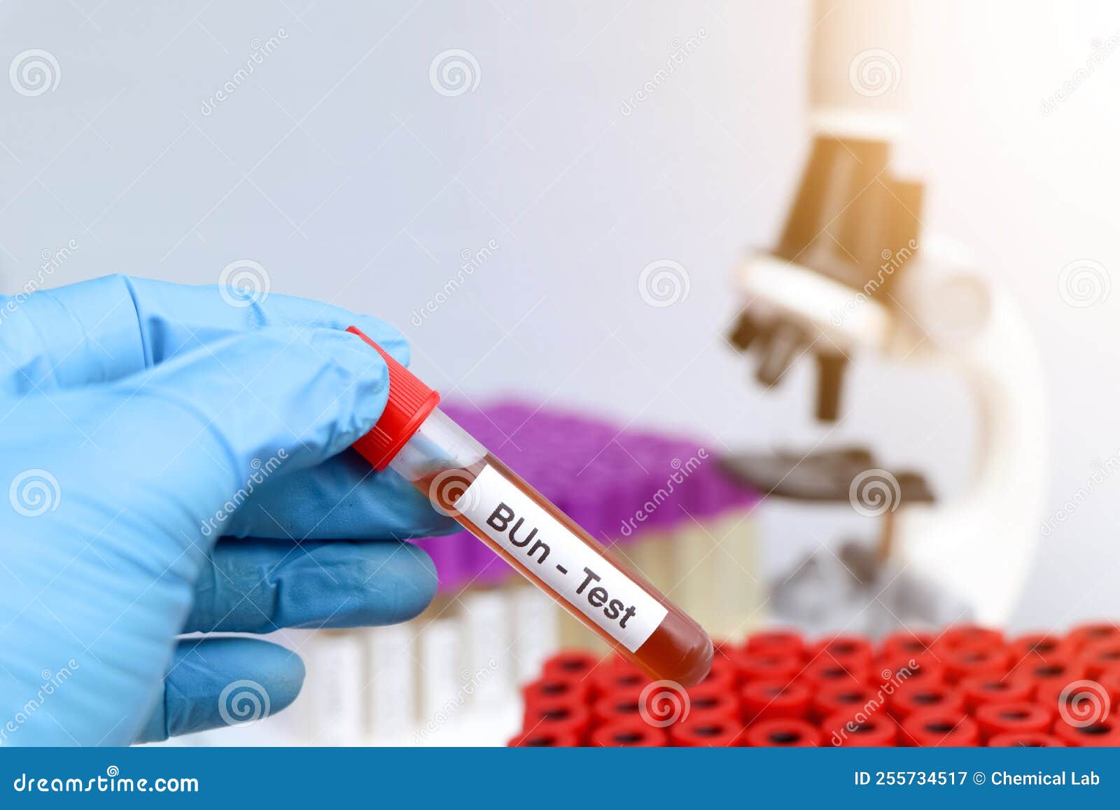 BUn Test from Blood , Blood Samples To Be Analyzed in the Laboratory ...