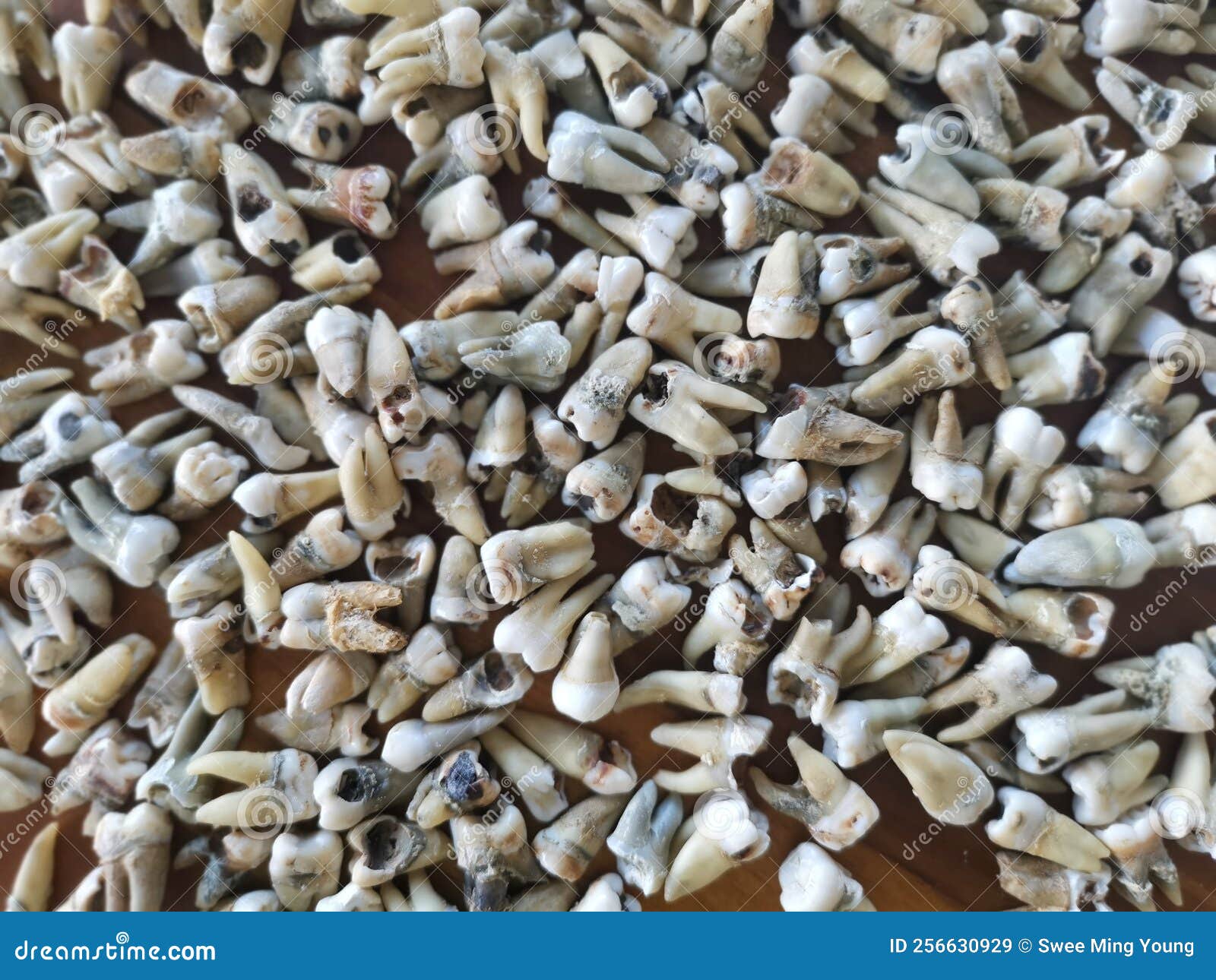 The Bundle of Unwanted Extracted Decay Human Teeth. Stock Image - Image ...