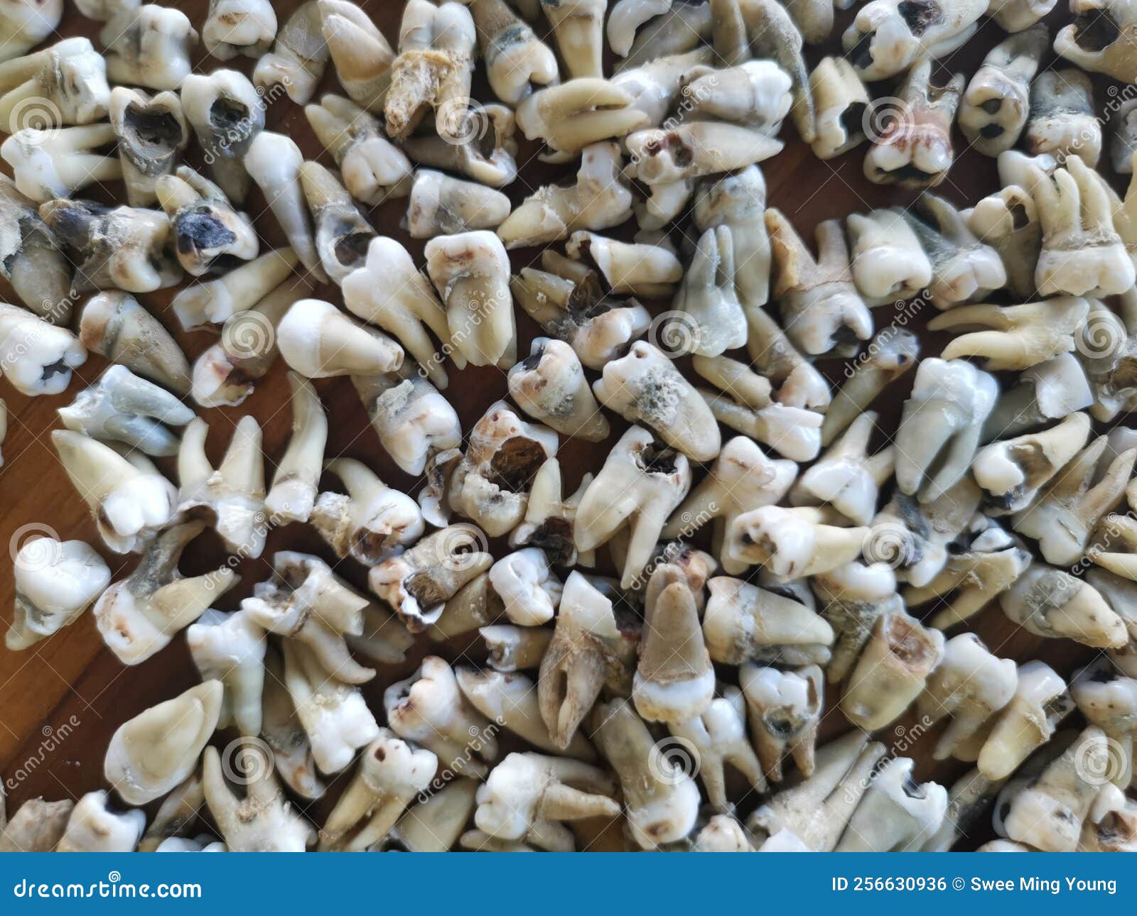 The Bundle of Unwanted Extracted Decay Human Teeth. Stock Photo - Image ...