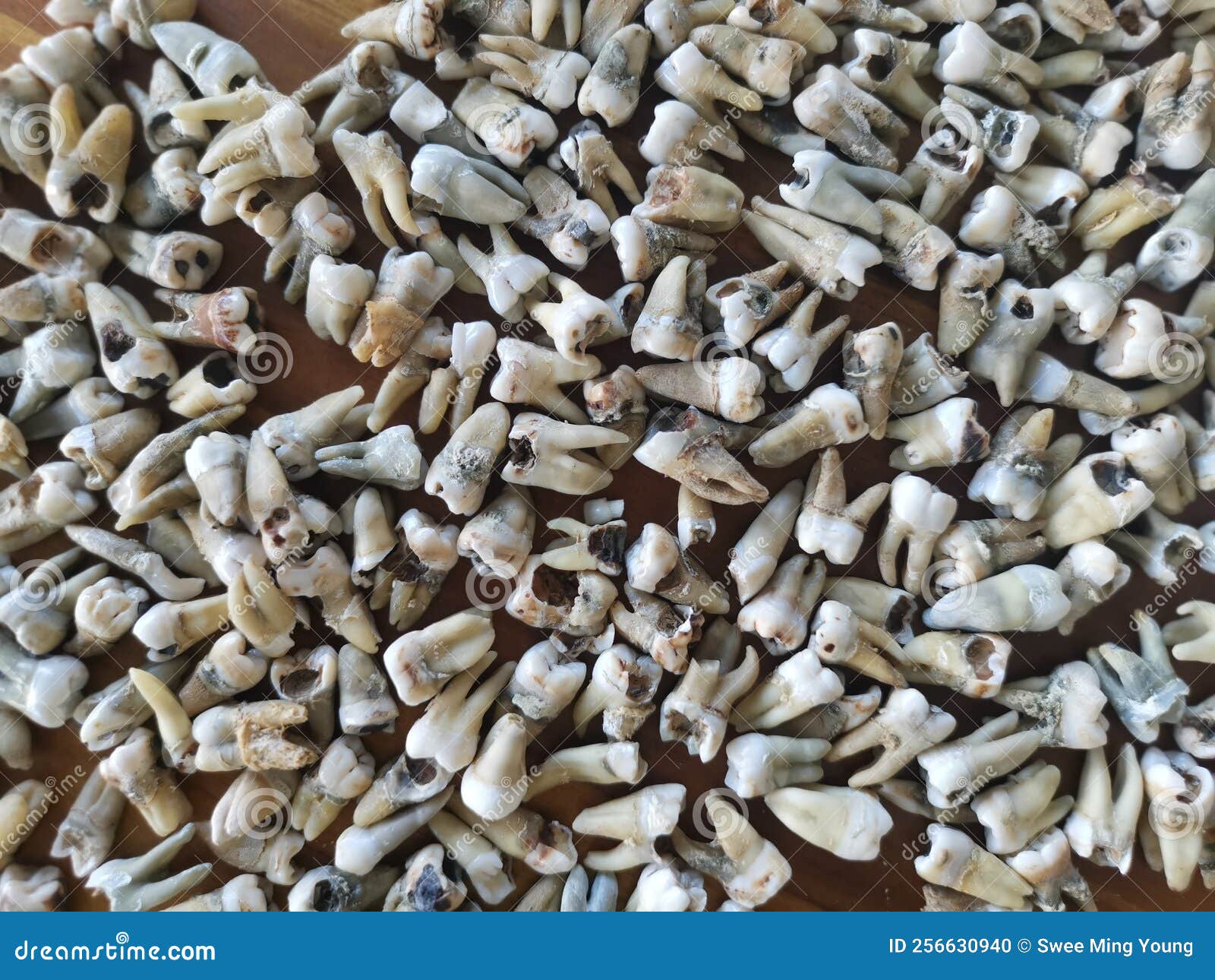 The Bundle of Unwanted Extracted Decay Human Teeth. Stock Photo - Image ...