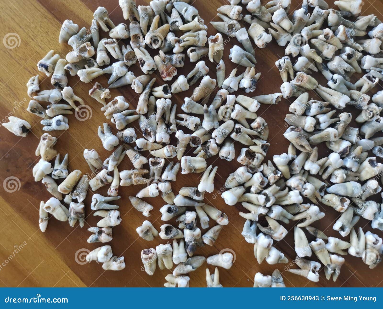 The Bundle of Unwanted Extracted Decay Human Teeth. Stock Image - Image ...