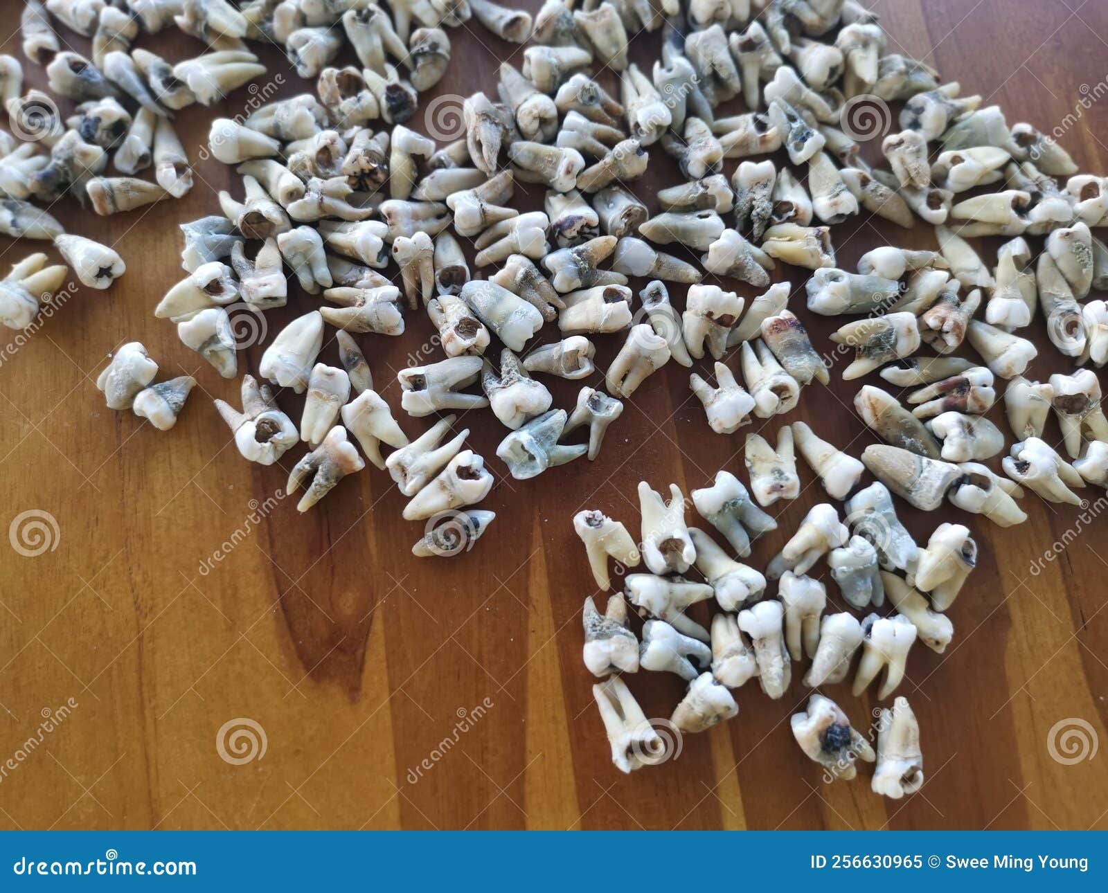 The Bundle of Unwanted Extracted Decay Human Teeth. Stock Image - Image ...