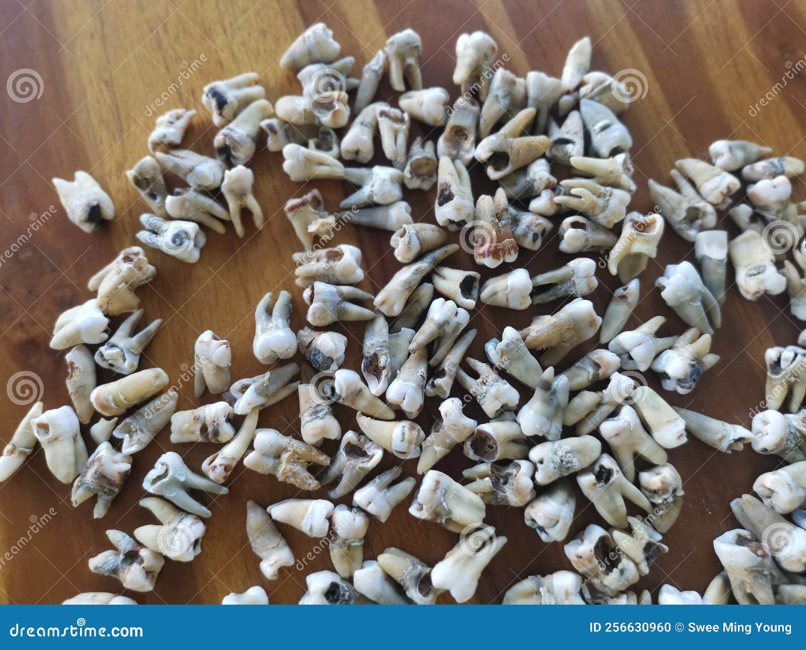 The Bundle of Unwanted Extracted Decay Human Teeth. Stock Photo - Image ...