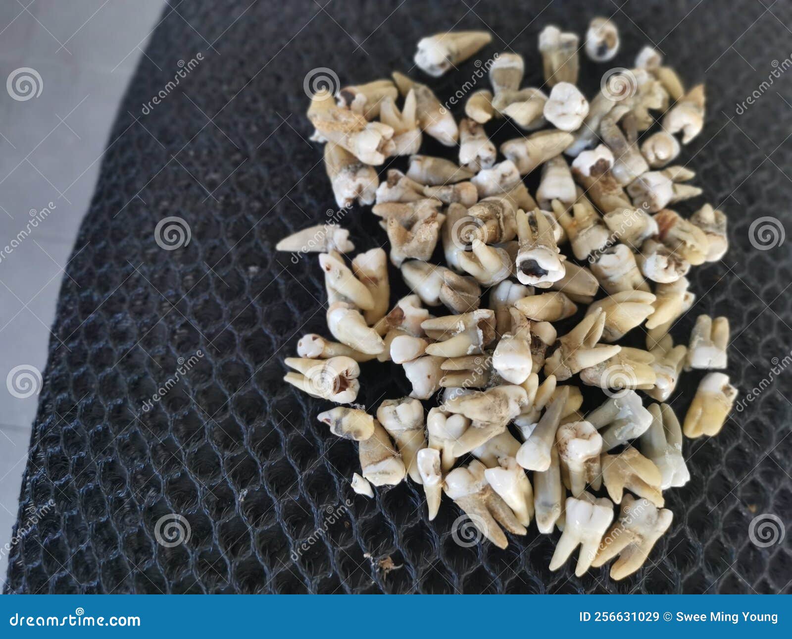 The Bundle of Unwanted Extracted Decay Human Teeth. Stock Image - Image ...