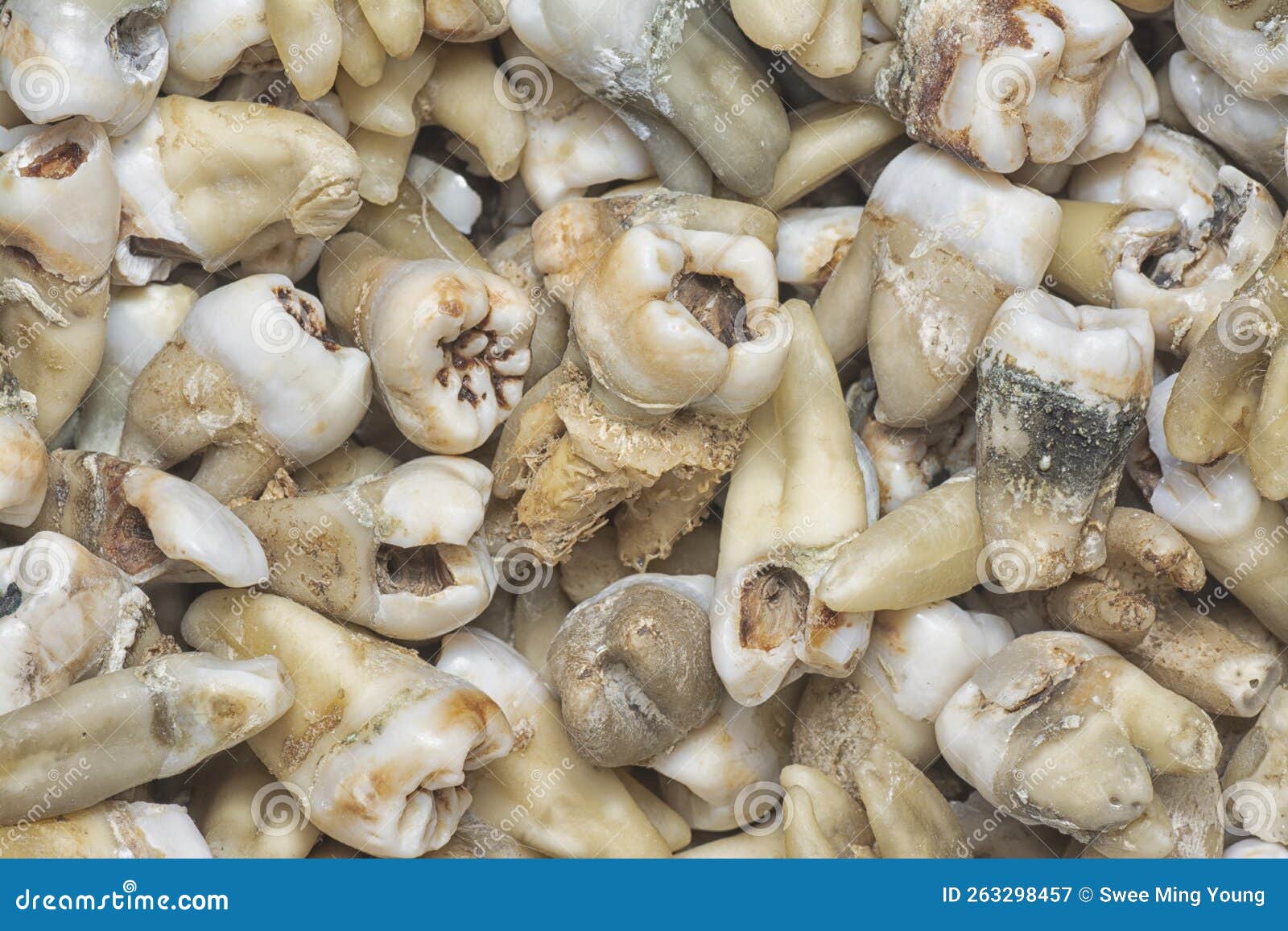 The Bundle of Unwanted Extracted Decay Human Teeth. Stock Image - Image ...