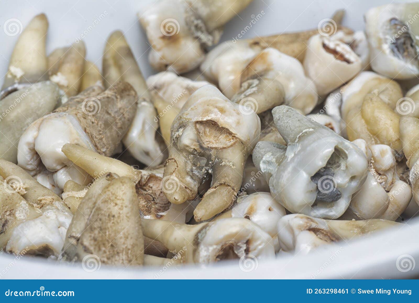 The Bundle of Unwanted Extracted Decay Human Teeth. Stock Image - Image ...