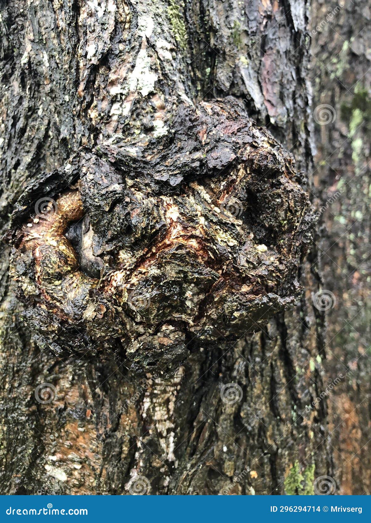 Burl Growth on a Tree Trunk with Cracked Bark, Rough Texture Stock ...