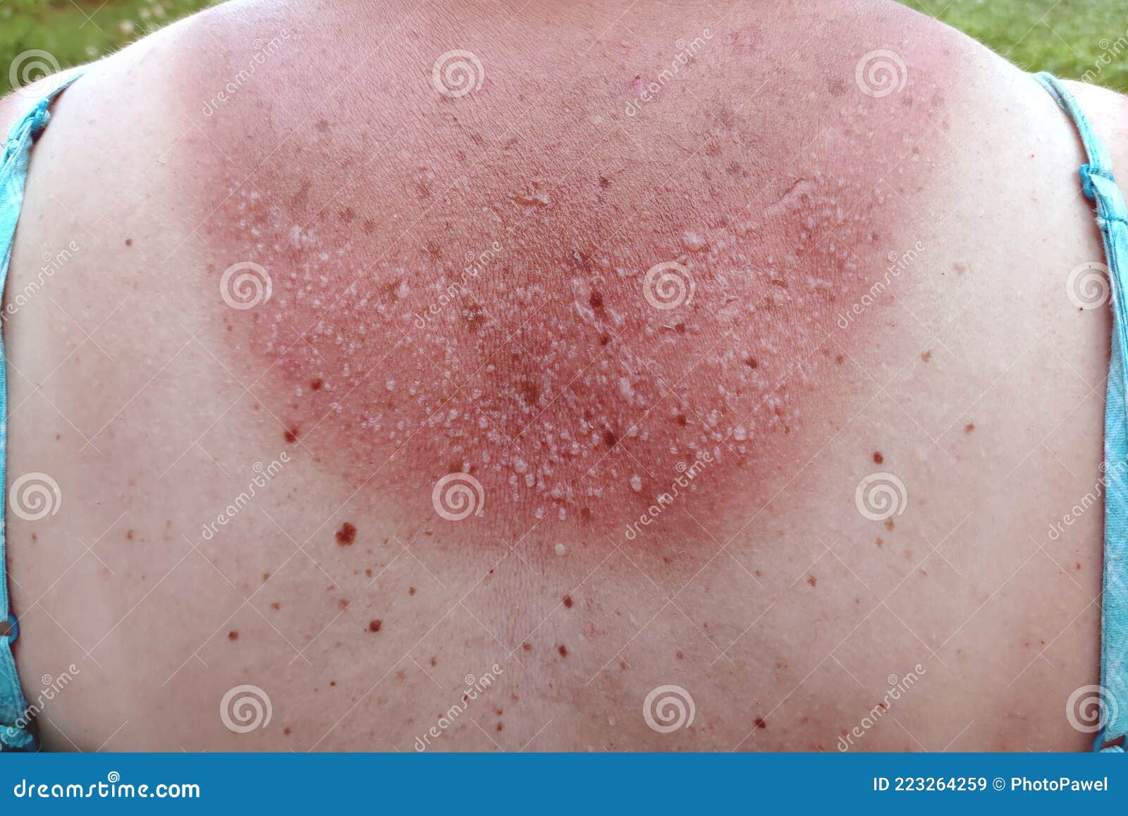 Burned Skin Leather Texture Royalty-Free Stock Photo | CartoonDealer ...