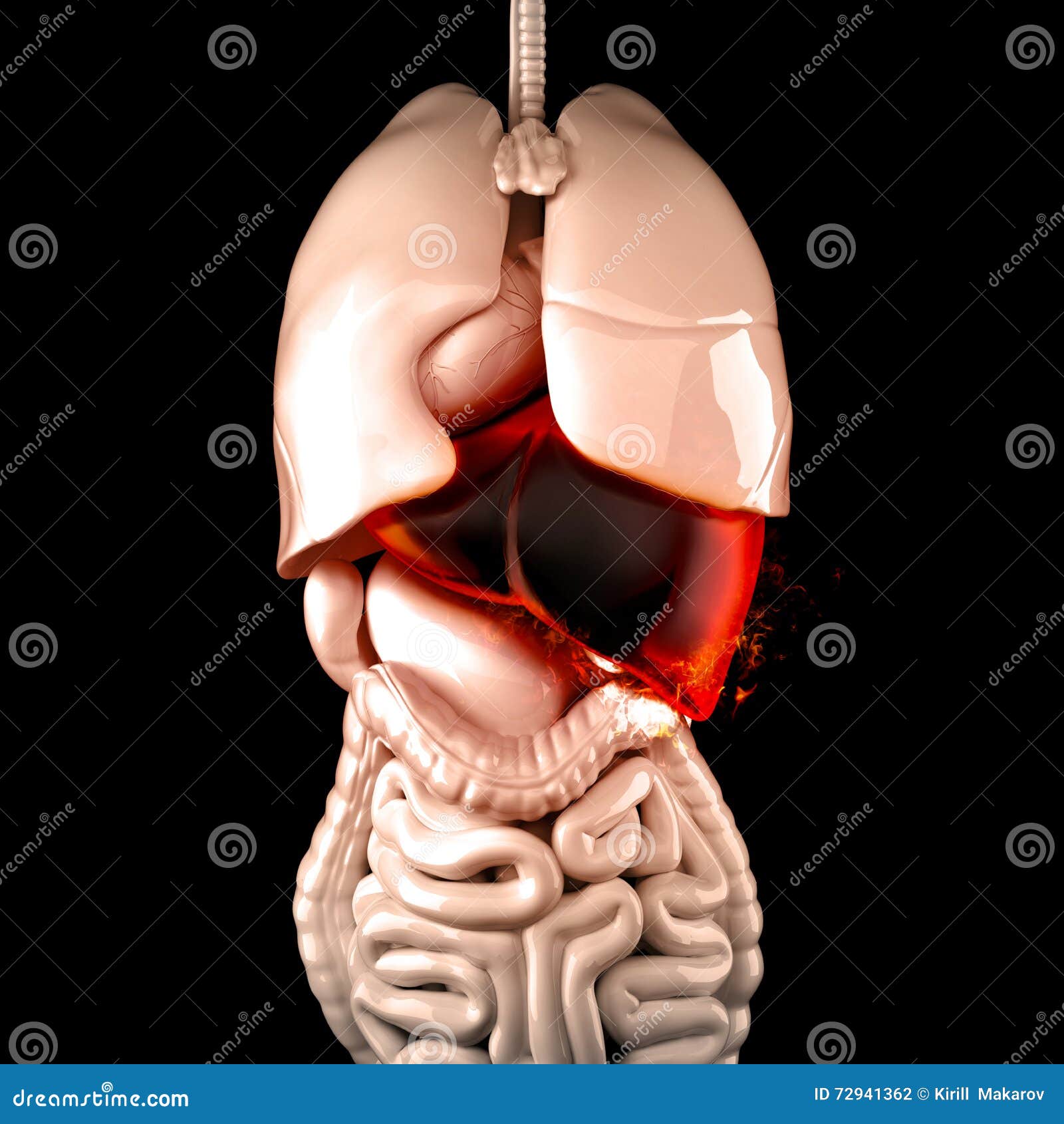 Burning Human Liver. Liver Disease Concept Stock Illustration ...