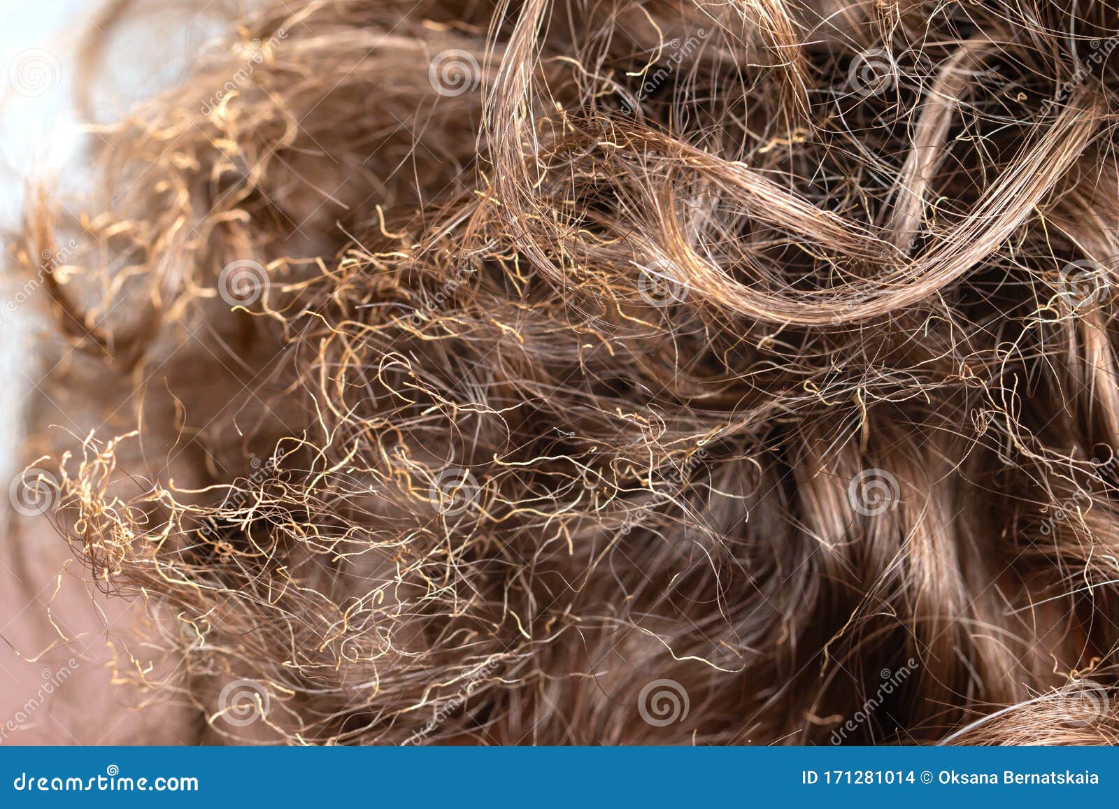 Burnt hair on his head stock photo. Image of dark, recovery - 171281014
