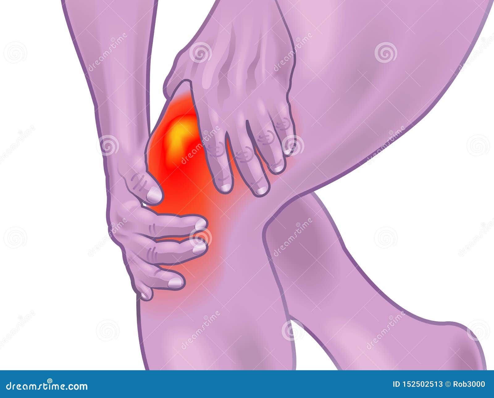 Bursitis illustration stock vector. Illustration of body - 152502513